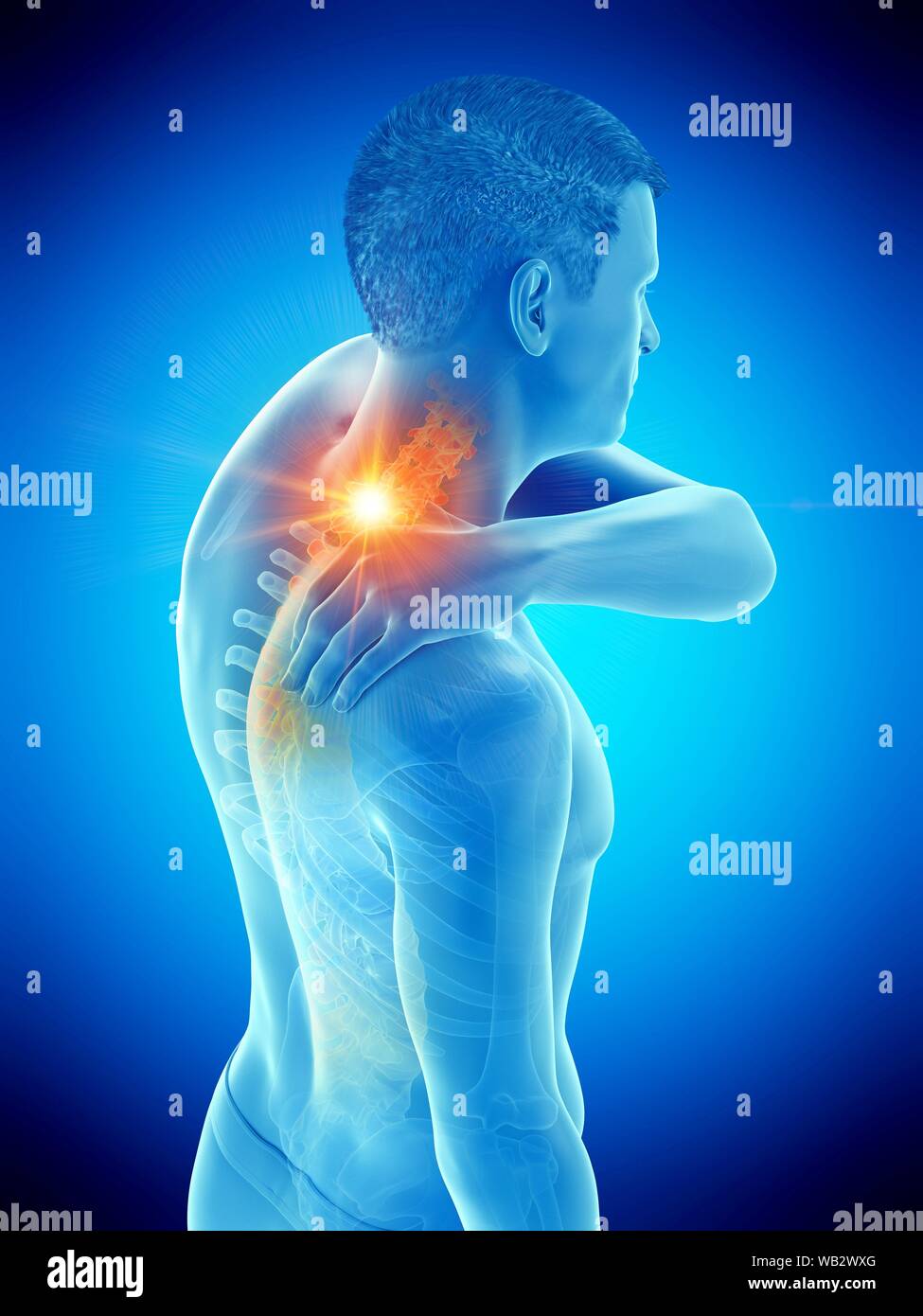 Neck pain, conceptual illustration Stock Photo - Alamy