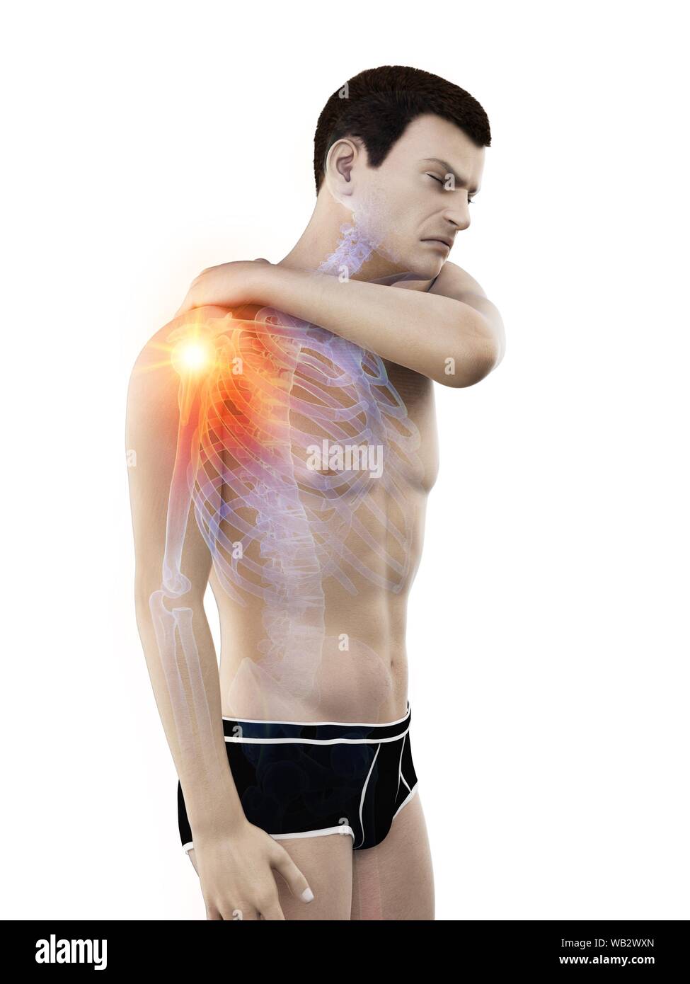 Shoulder pain, conceptual illustration Stock Photo - Alamy Shoulder pain, conceptual illustration Stock Photo - Alamy