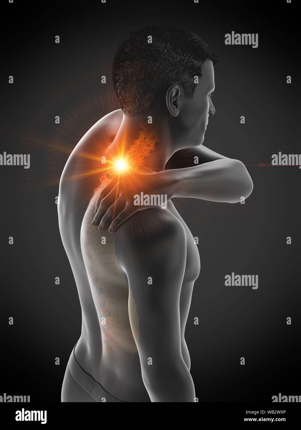 Neck pain, conceptual illustration Stock Photo - Alamy