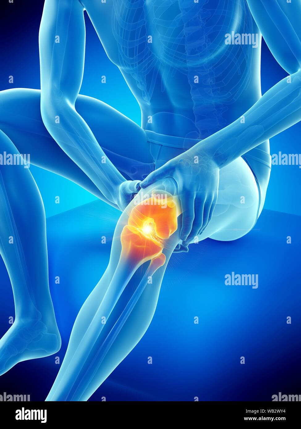 Knee pain, conceptual illustration Stock Photo - Alamy
