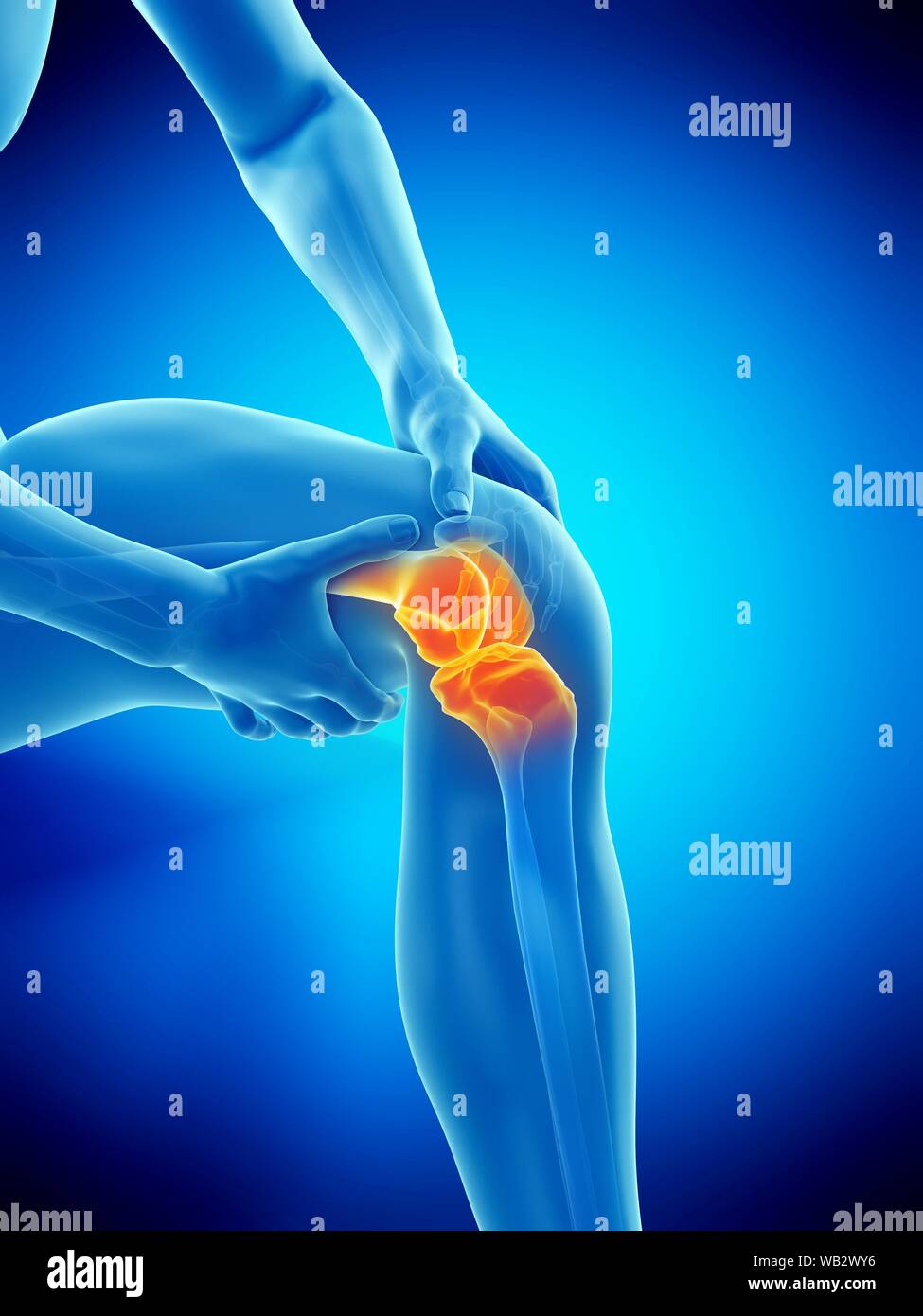 Knee pain, conceptual illustration Stock Photo - Alamy