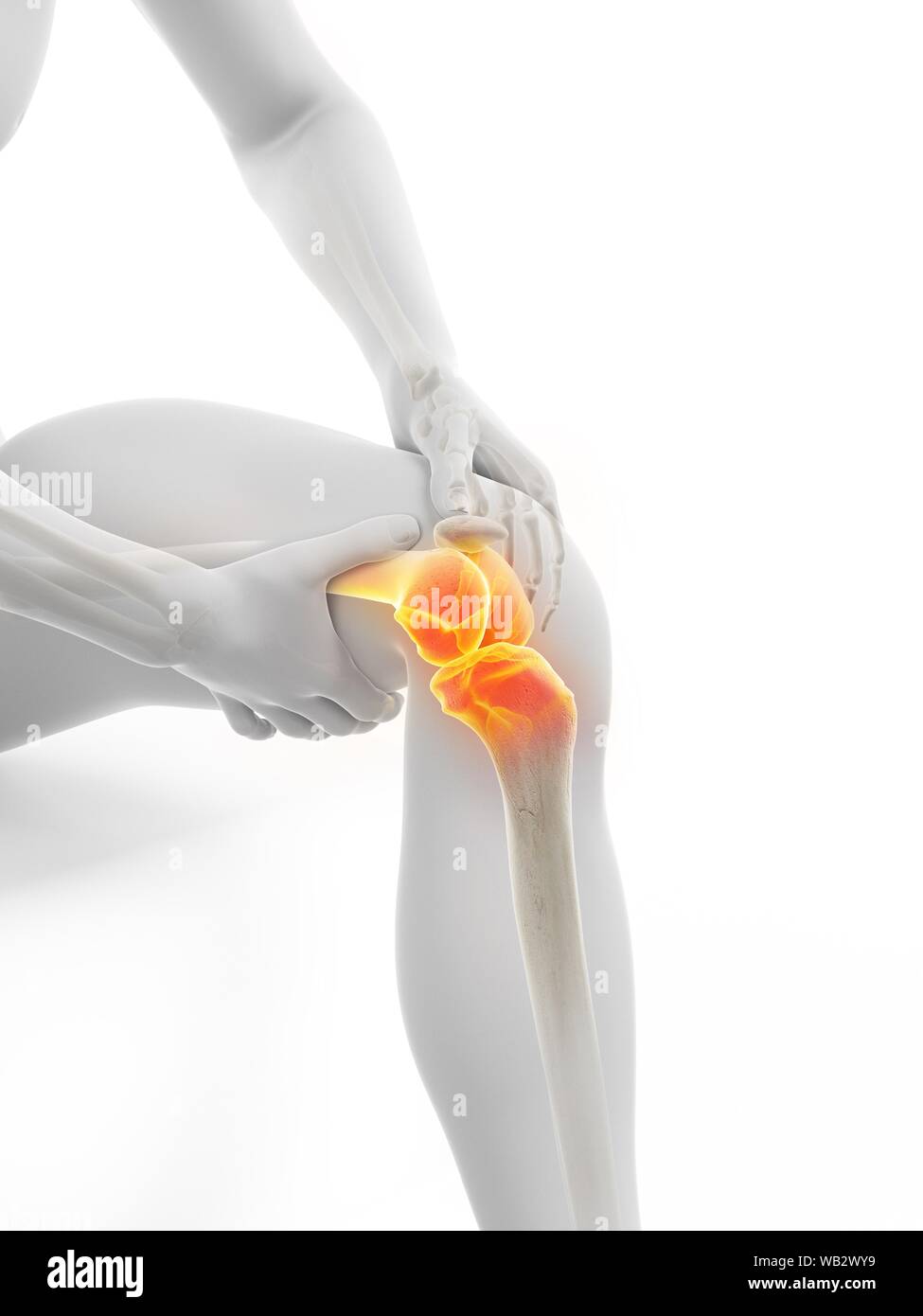 Knee pain, conceptual illustration Stock Photo - Alamy