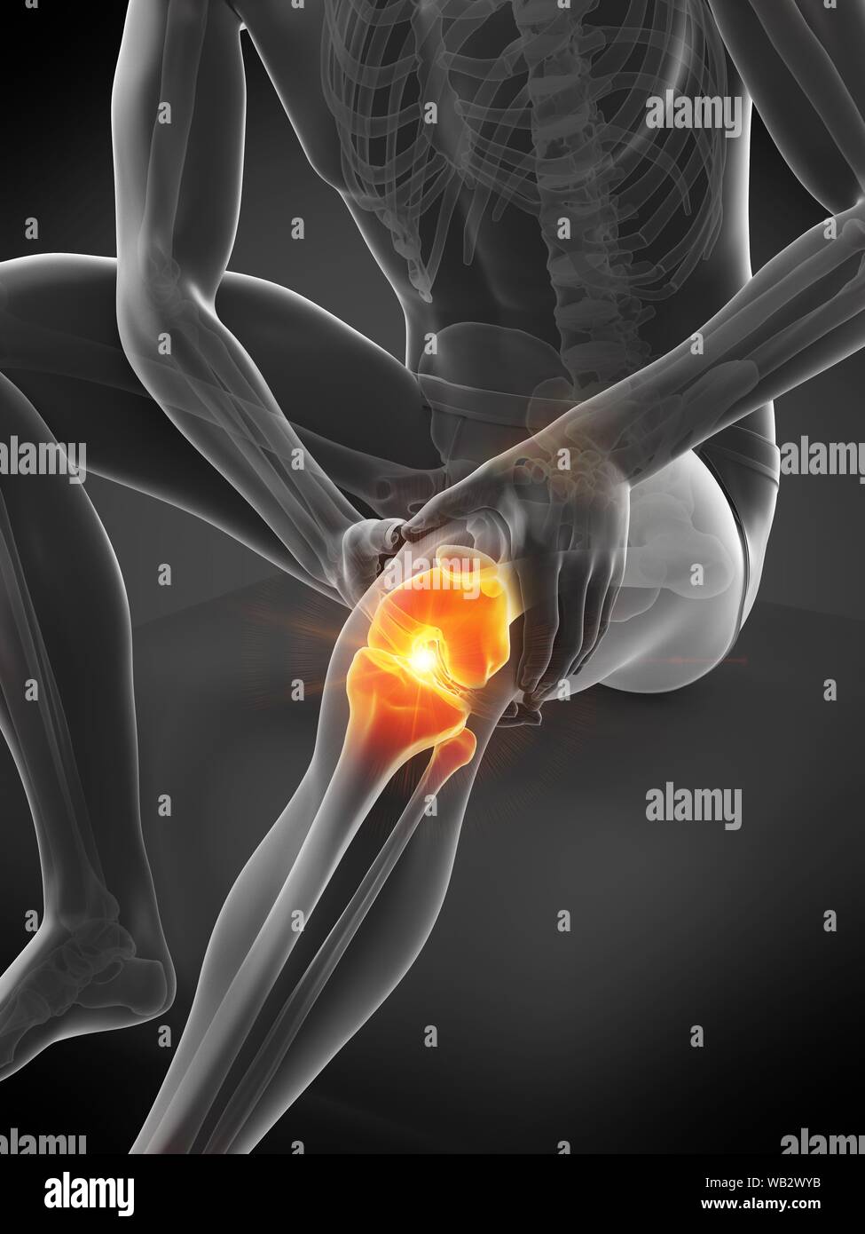 Knee pain, conceptual illustration Stock Photo - Alamy