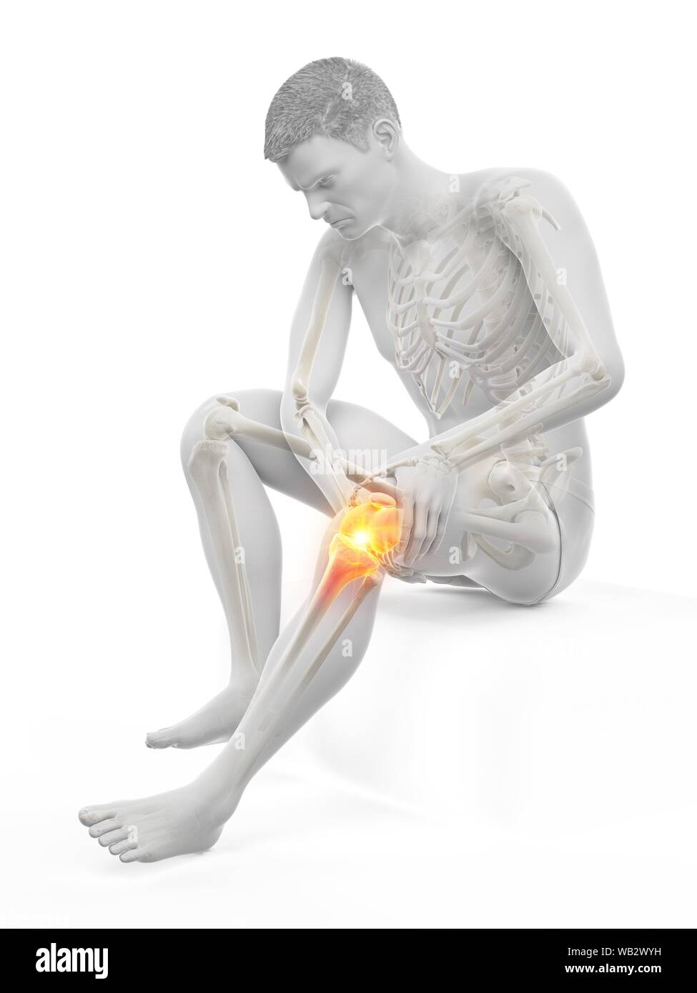 Knee pain, conceptual illustration Stock Photo - Alamy
