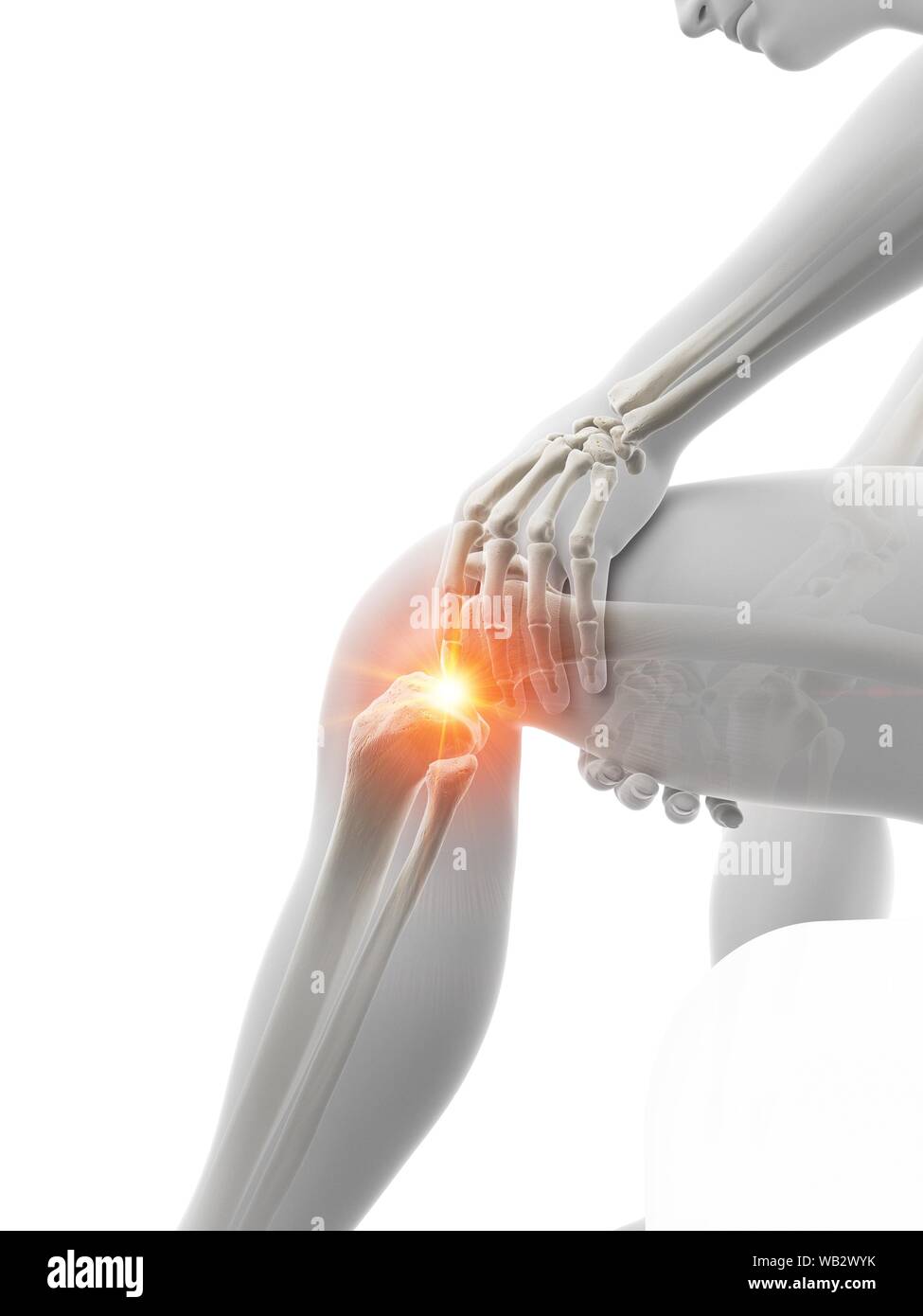 Knee pain, conceptual illustration Stock Photo - Alamy