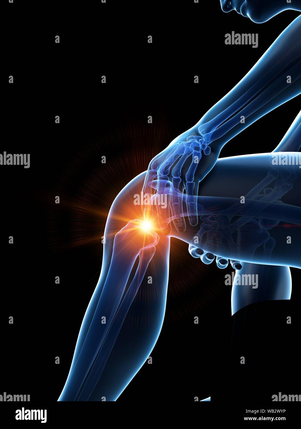 Knee pain, conceptual illustration Stock Photo - Alamy