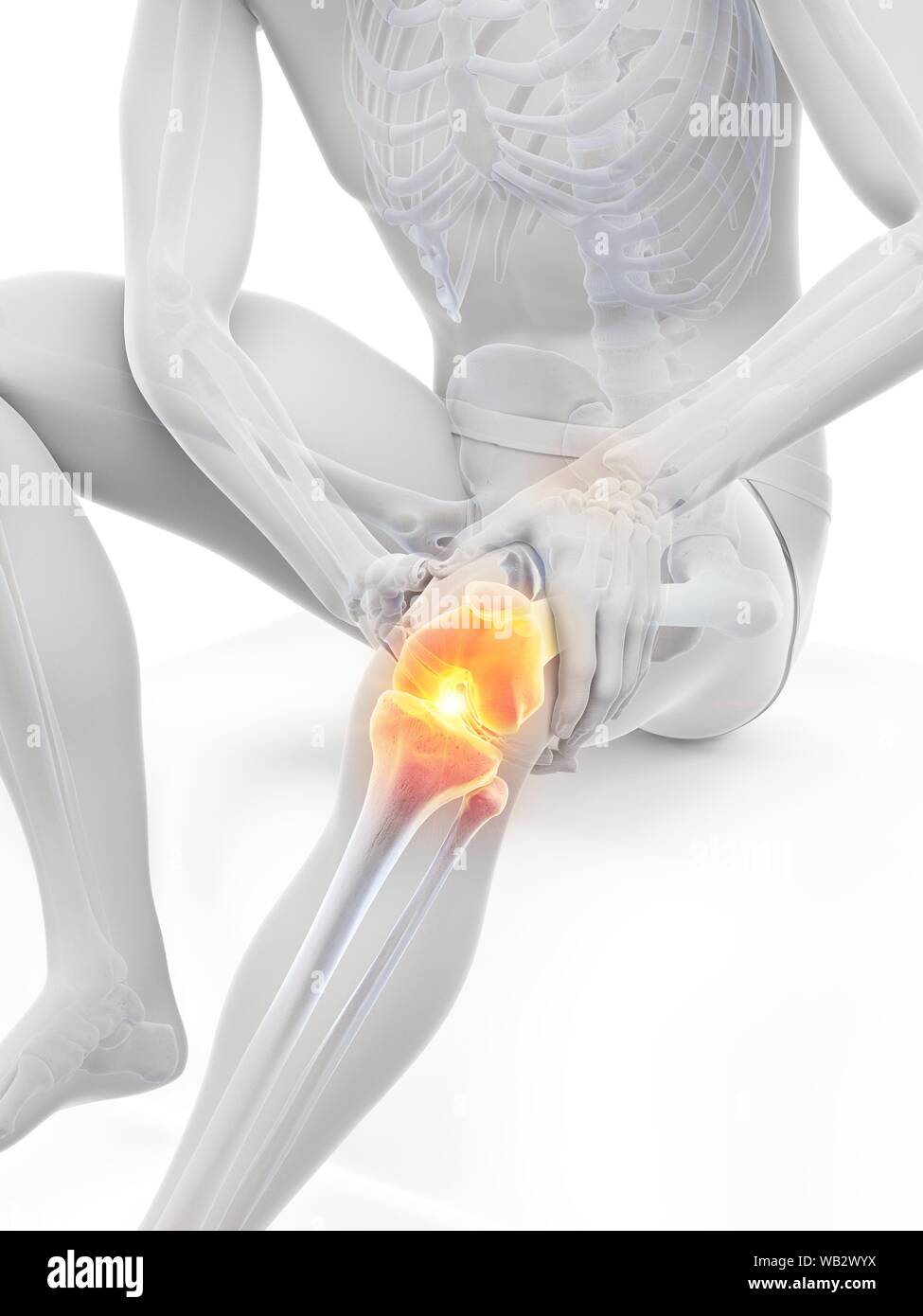 Knee pain, conceptual illustration Stock Photo - Alamy