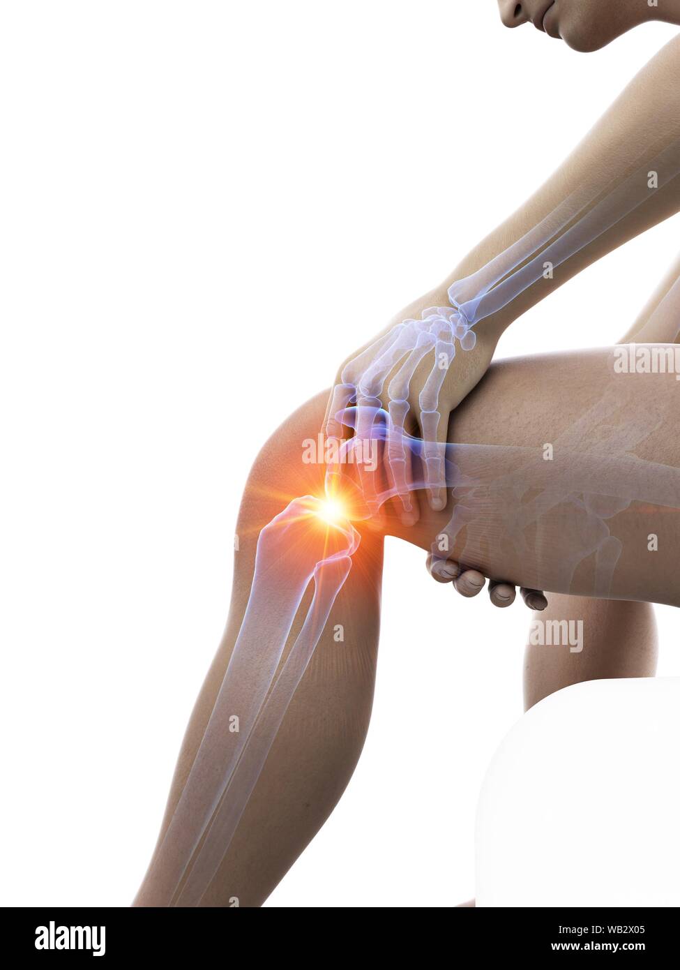 Knee pain, conceptual illustration Stock Photo - Alamy