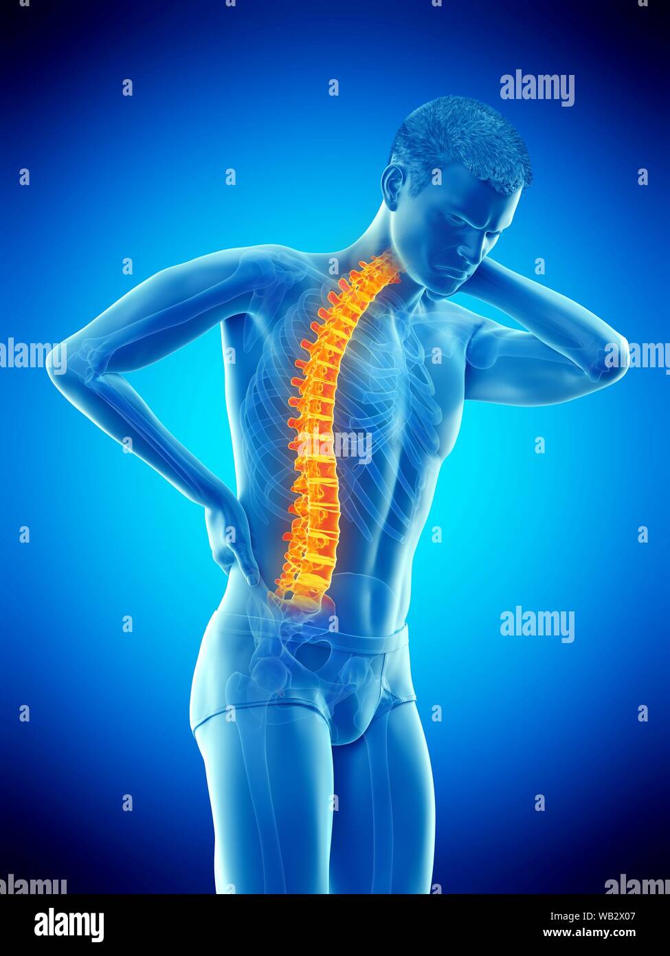 Back pain, conceptual illustration Stock Photo - Alamy