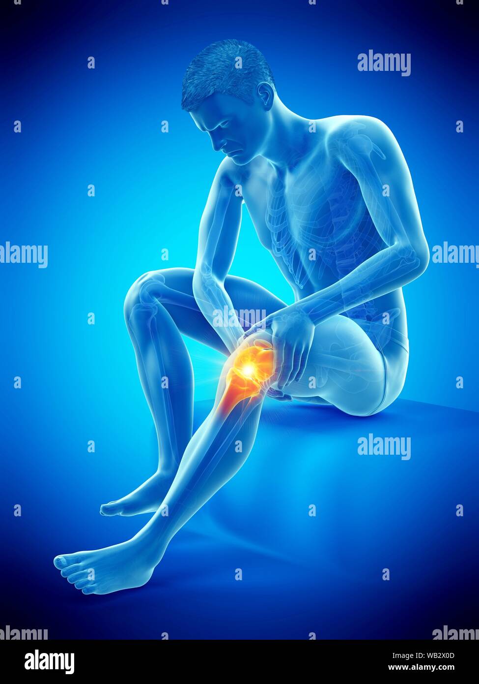 Knee pain, conceptual illustration Stock Photo - Alamy