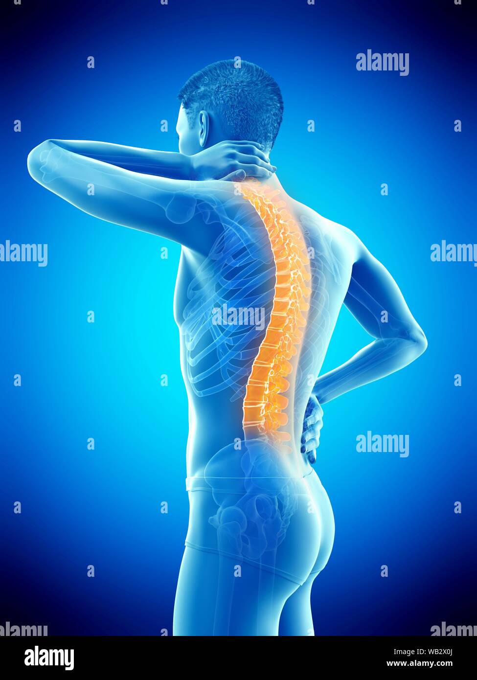 Back pain, conceptual illustration Stock Photo - Alamy