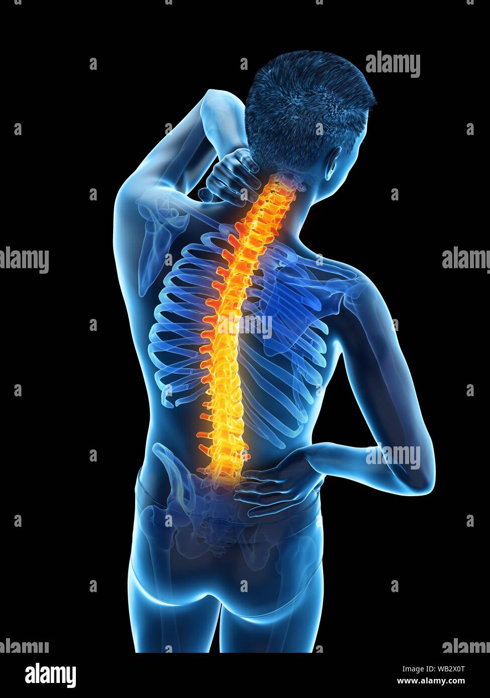 Back pain, conceptual illustration Stock Photo - Alamy
