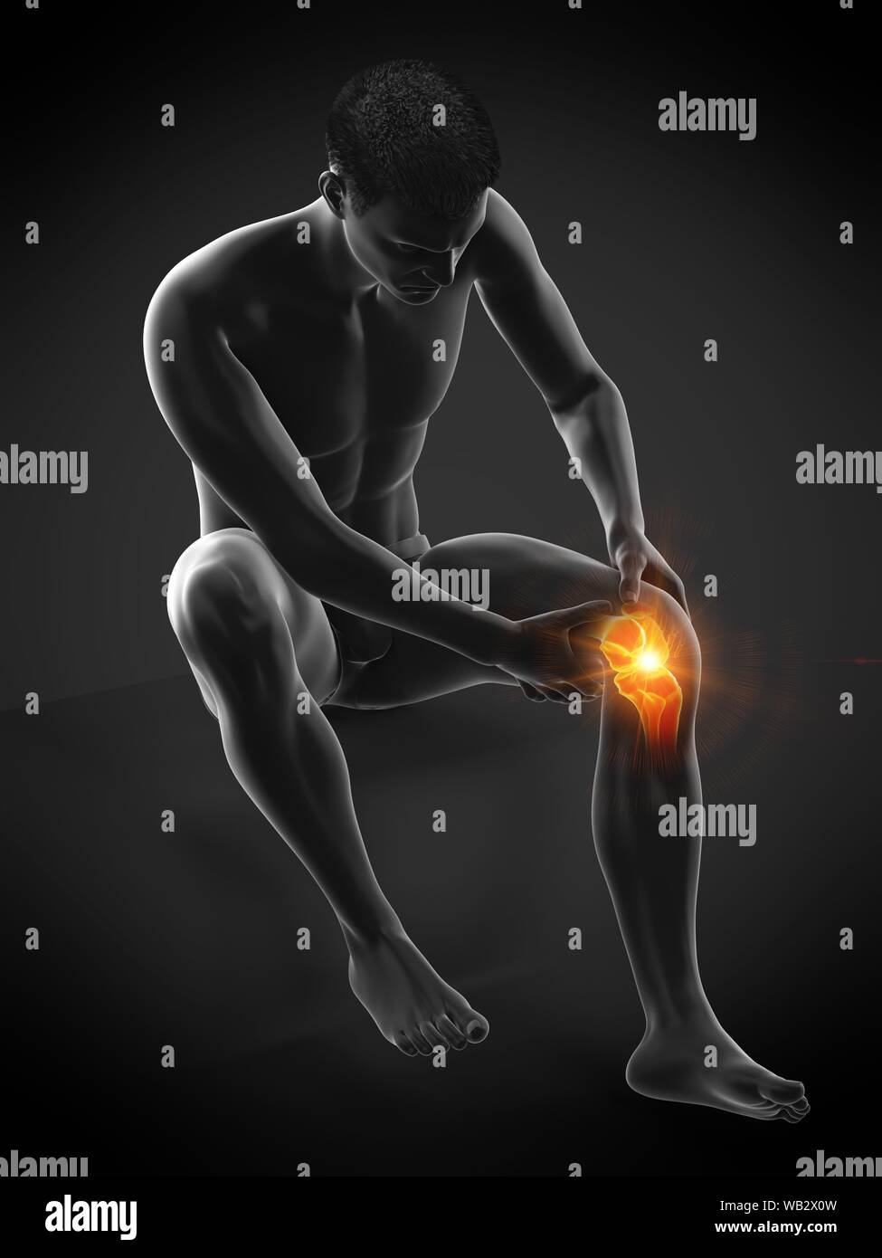 Knee pain, conceptual illustration Stock Photo - Alamy