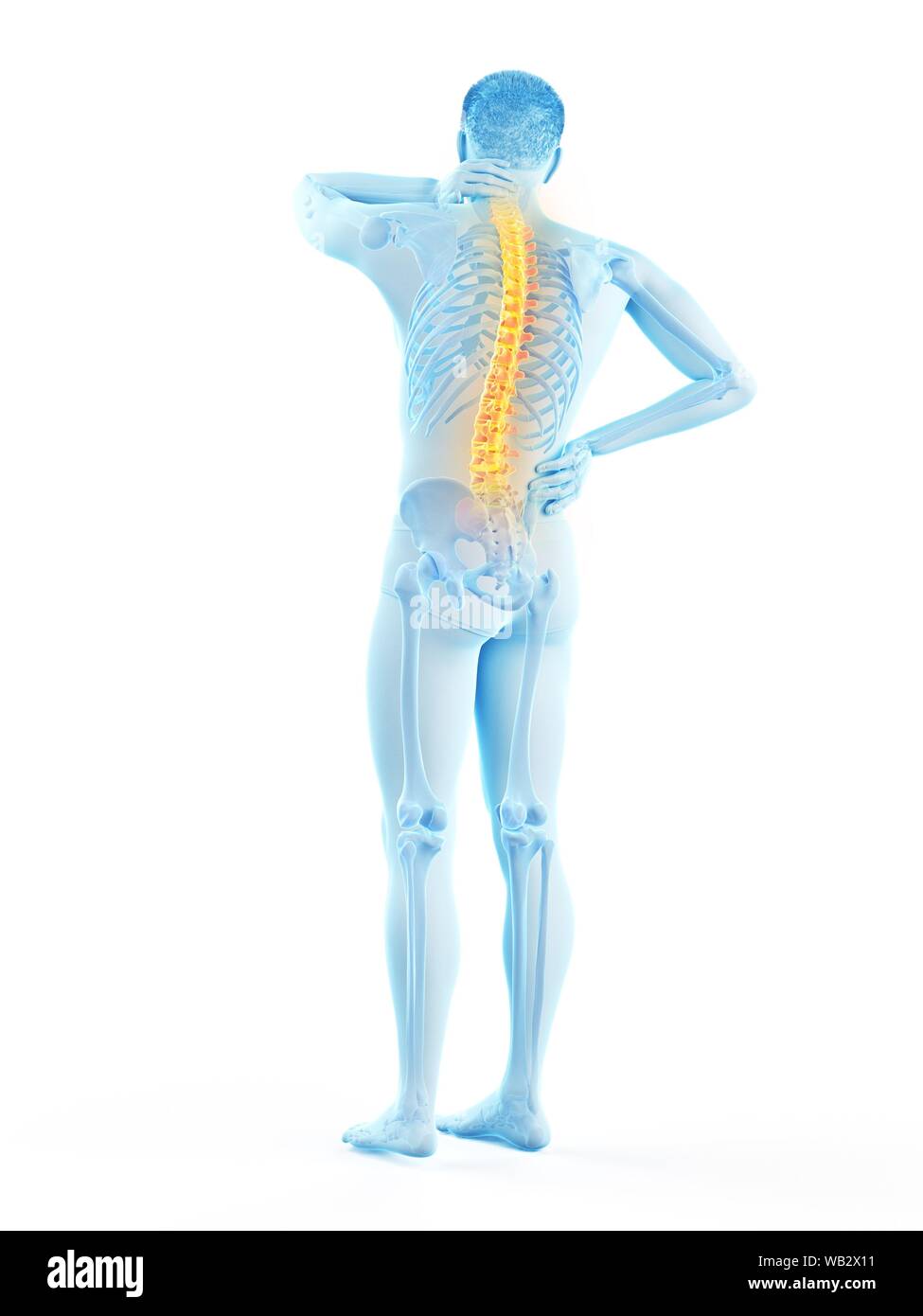 Back pain, conceptual illustration Stock Photo - Alamy