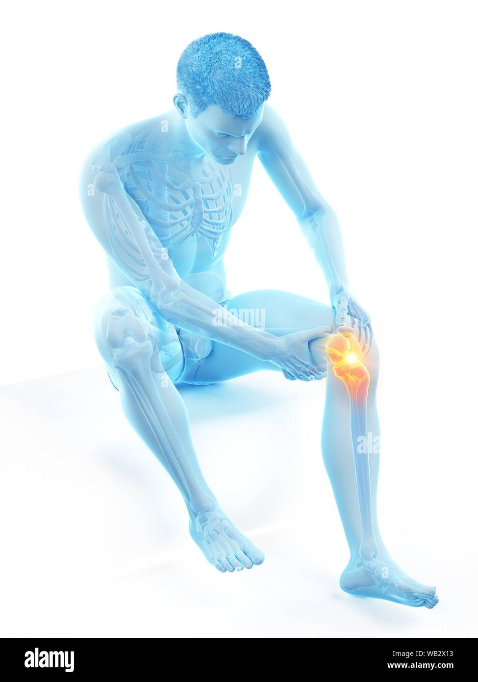 Knee pain, conceptual illustration Stock Photo - Alamy