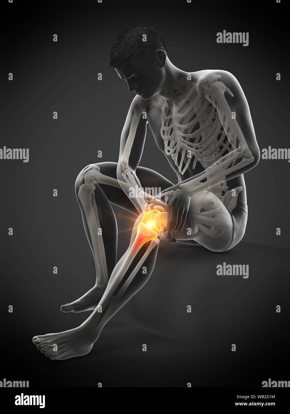 Knee pain, conceptual illustration Stock Photo - Alamy