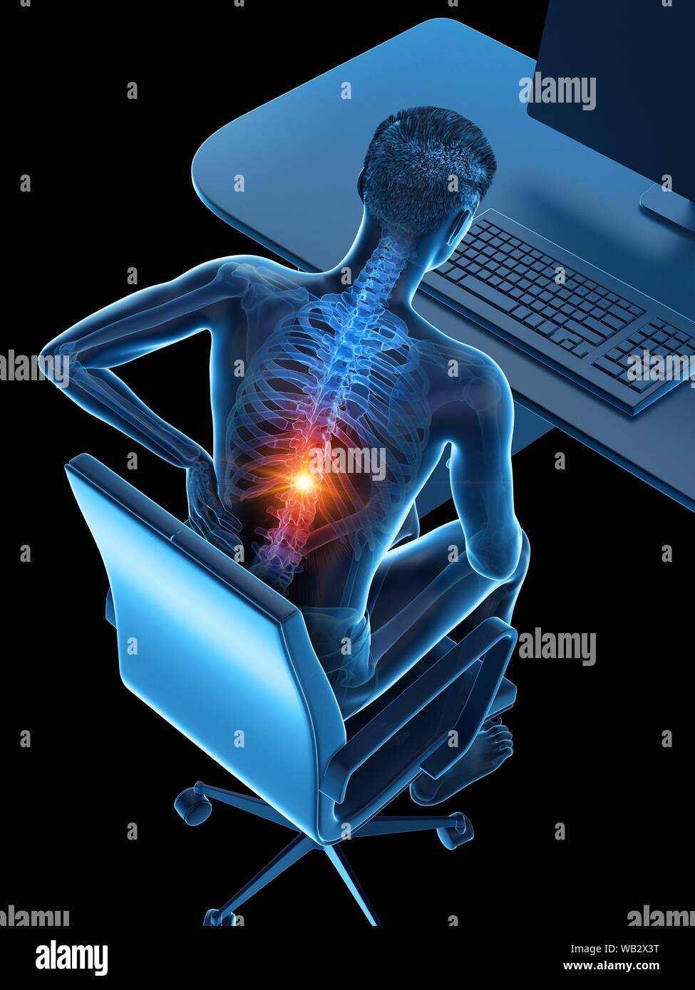 Back pain due to sitting, conceptual illustration Stock Photo - Alamy