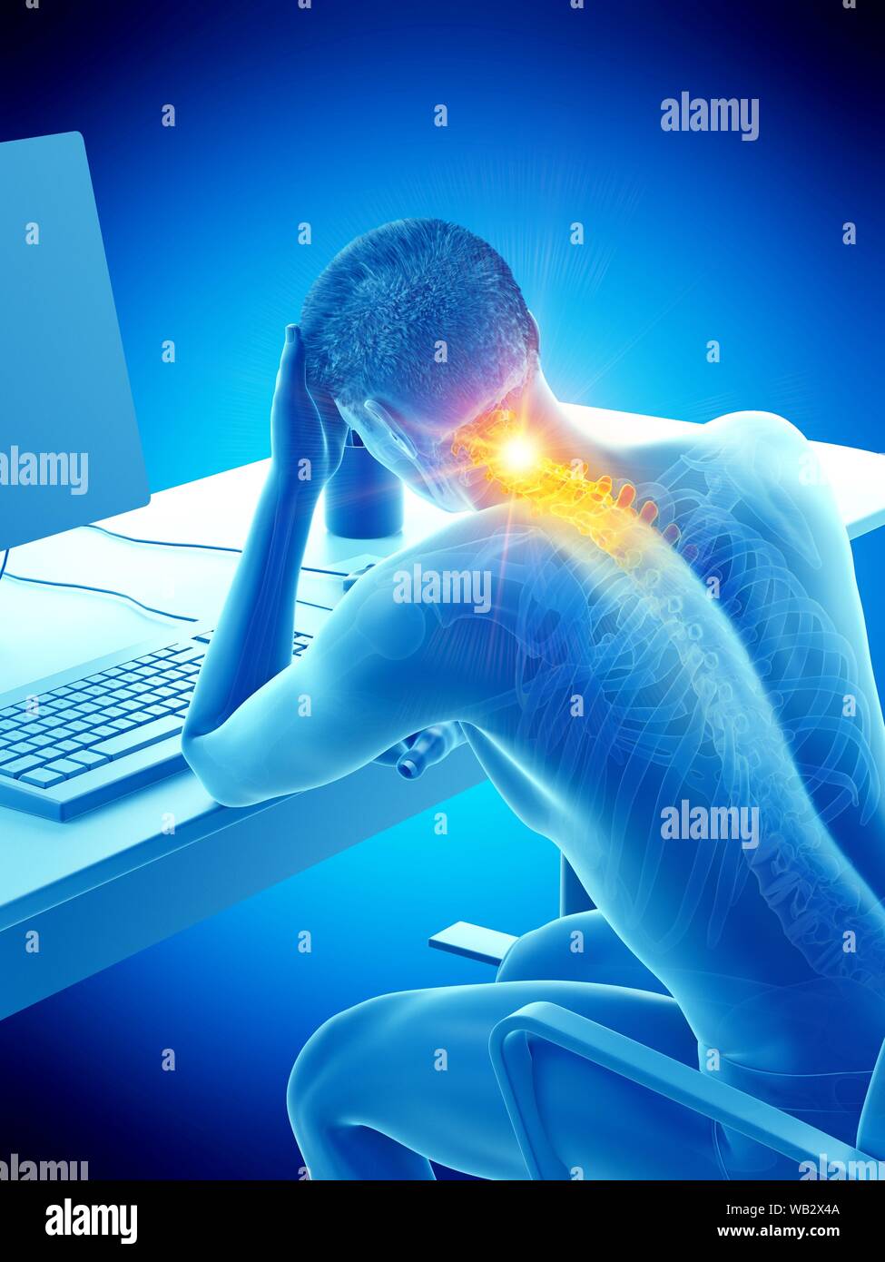 Office worker with neck pain, conceptual illustration Stock Photo - Alamy