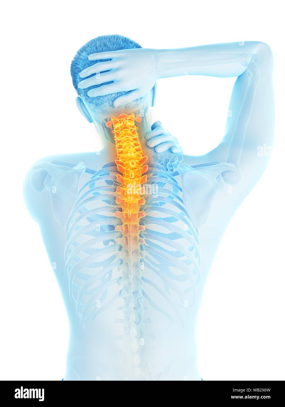 Neck pain, conceptual illustration Stock Photo - Alamy