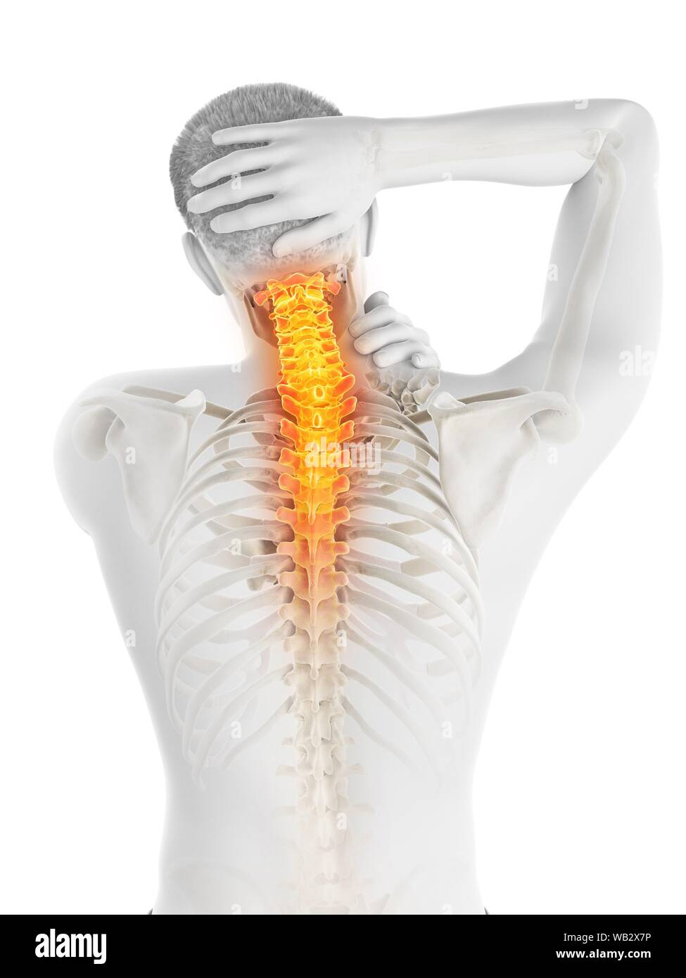 Neck pain, conceptual illustration Stock Photo - Alamy