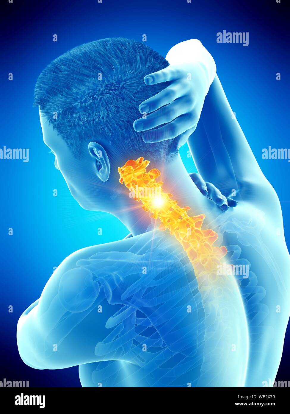 Neck pain, conceptual illustration Stock Photo - Alamy