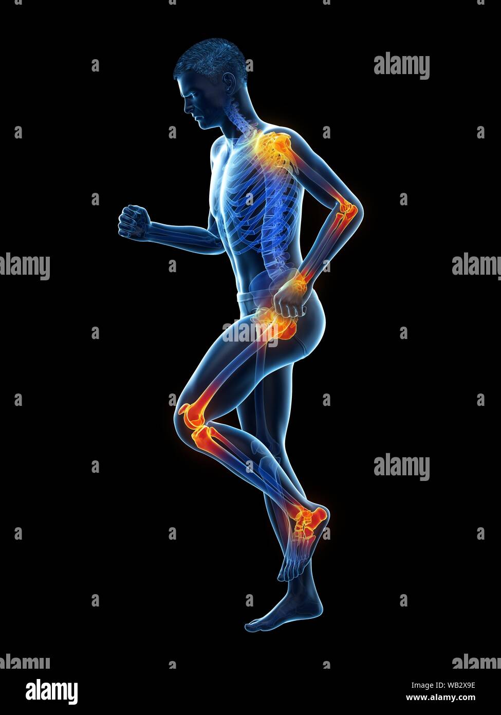 Joint pain, conceptual illustration Stock Photo - Alamy