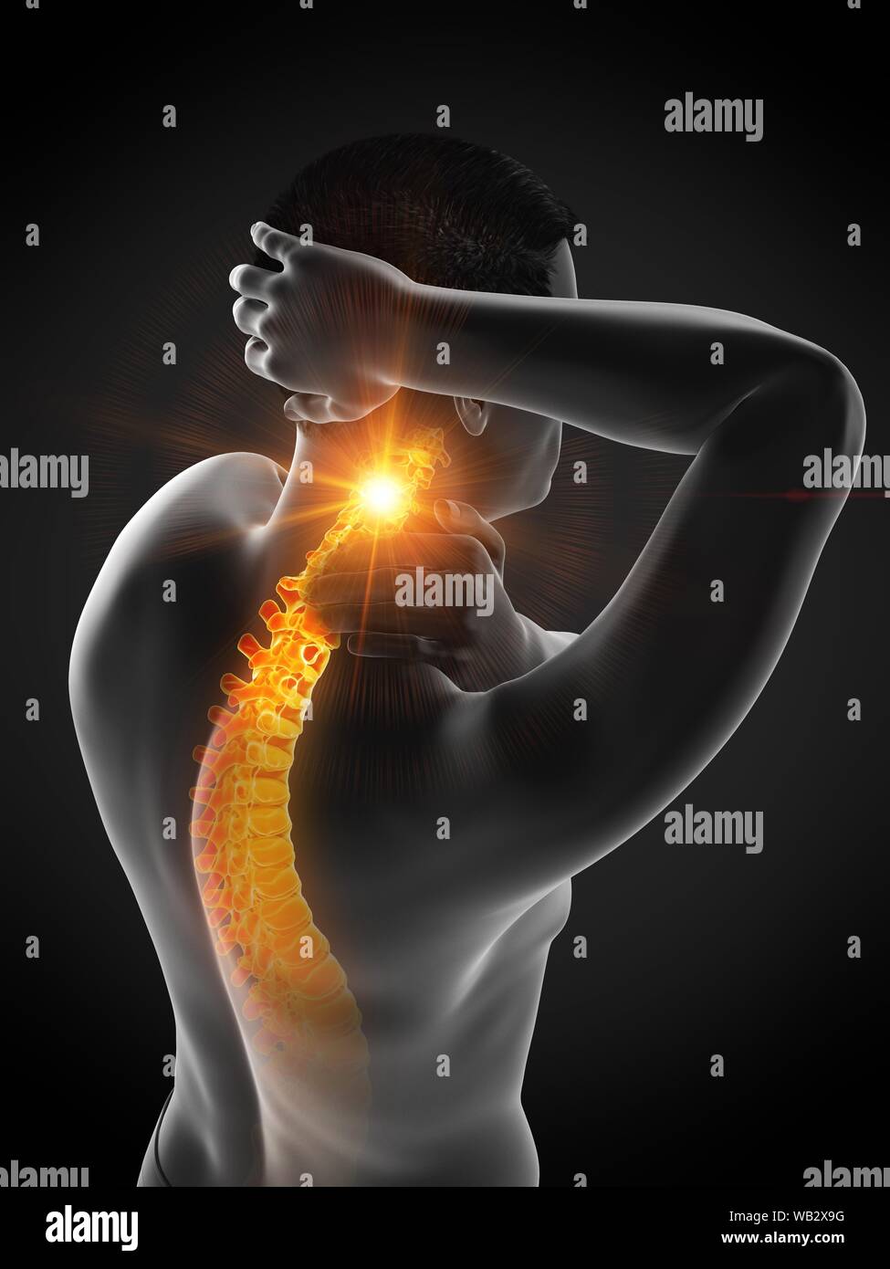 Neck pain, conceptual illustration Stock Photo - Alamy