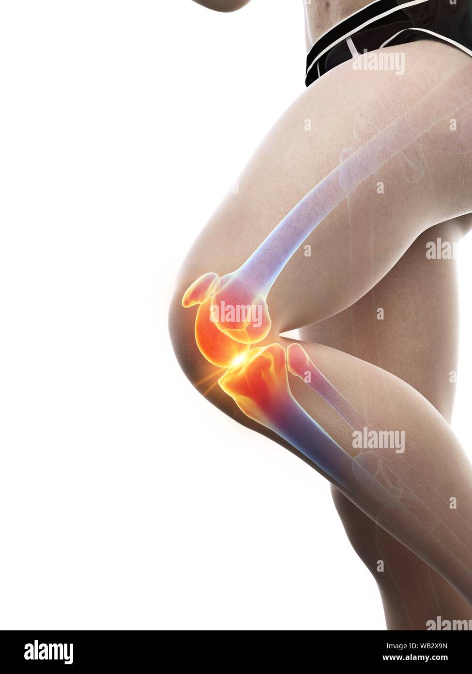 knee pain, conceptual illustration Stock Photo - Alamy