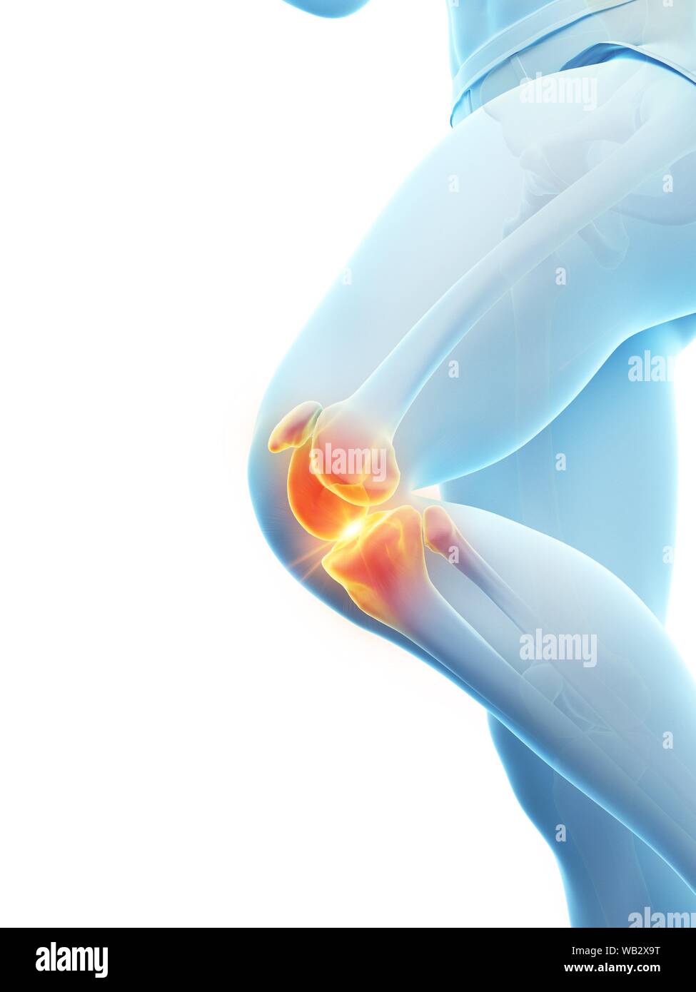knee pain, conceptual illustration Stock Photo - Alamy