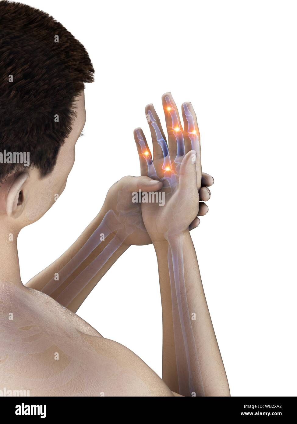 Finger pain, conceptual illustration Stock Photo - Alamy