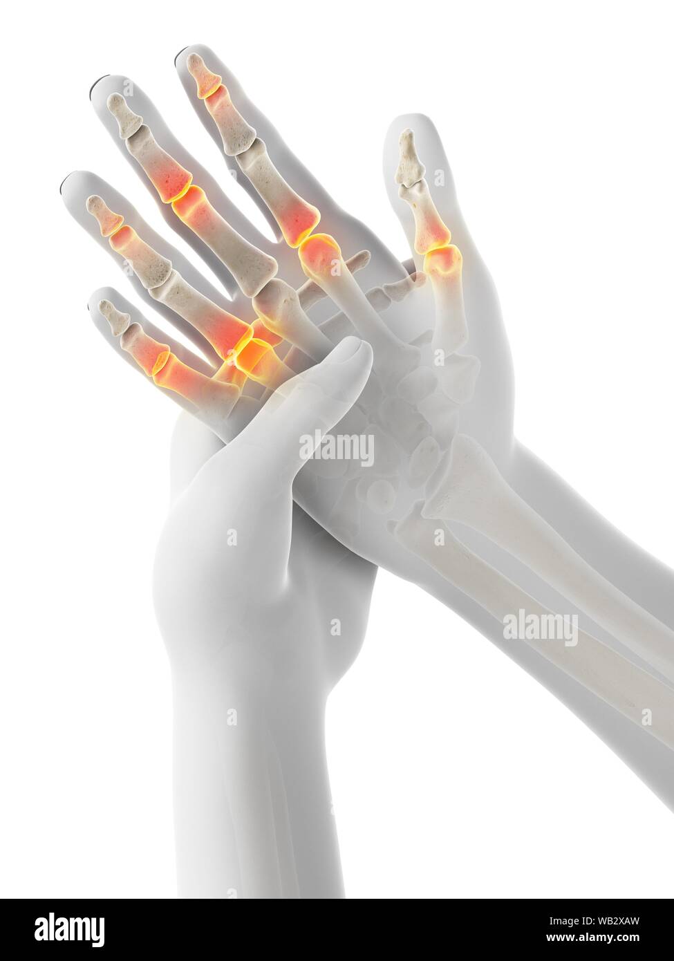 Finger pain, conceptual illustration Stock Photo - Alamy