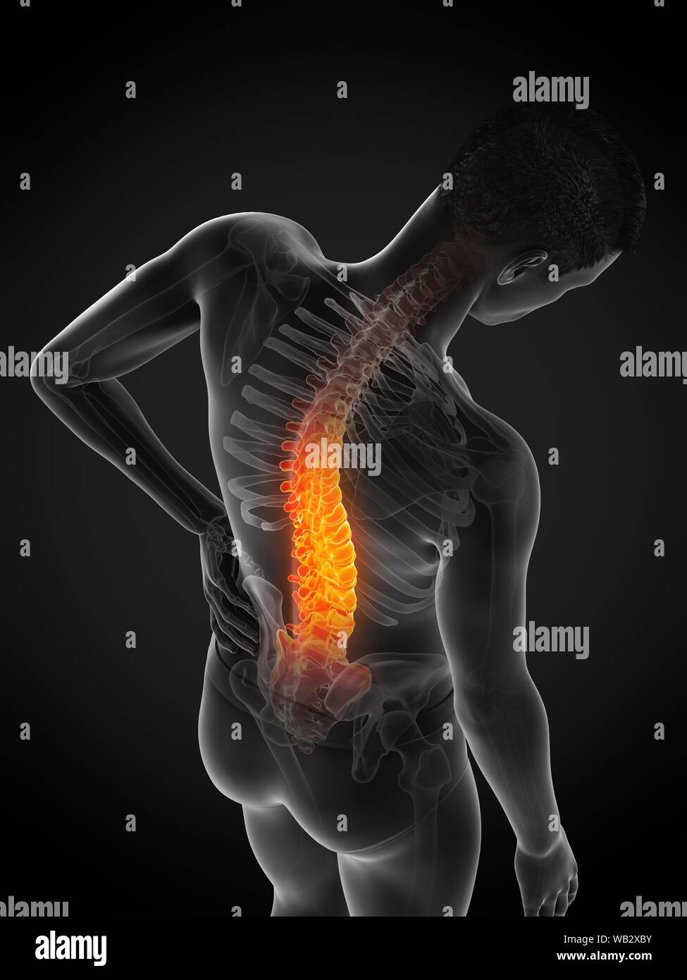 Back pain, conceptual illustration Stock Photo - Alamy