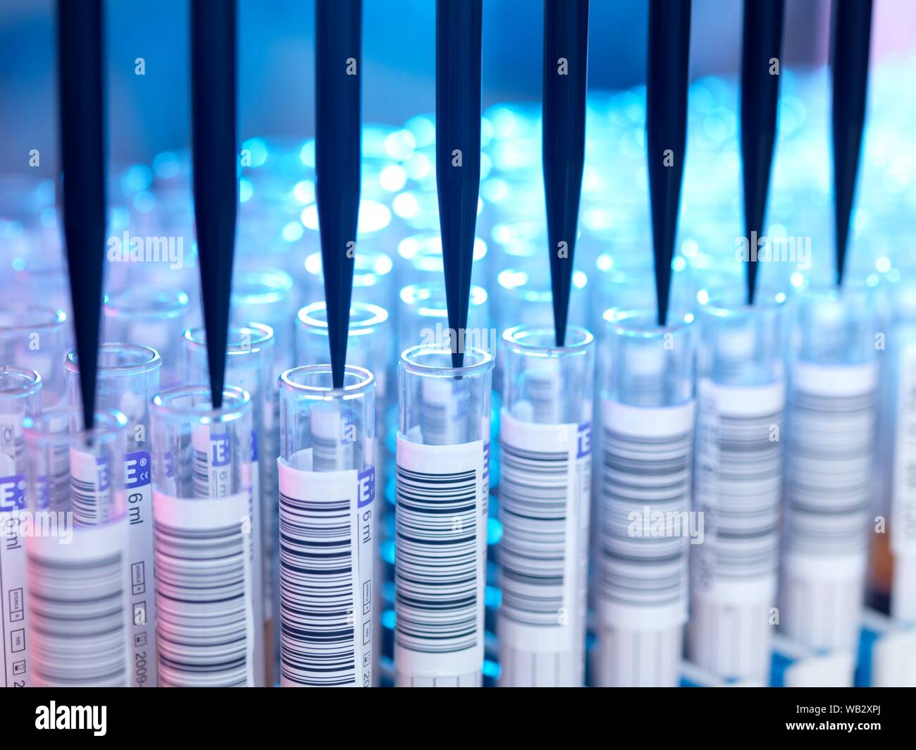 Automated blood sample testing in laboratory for healthcare screening ...