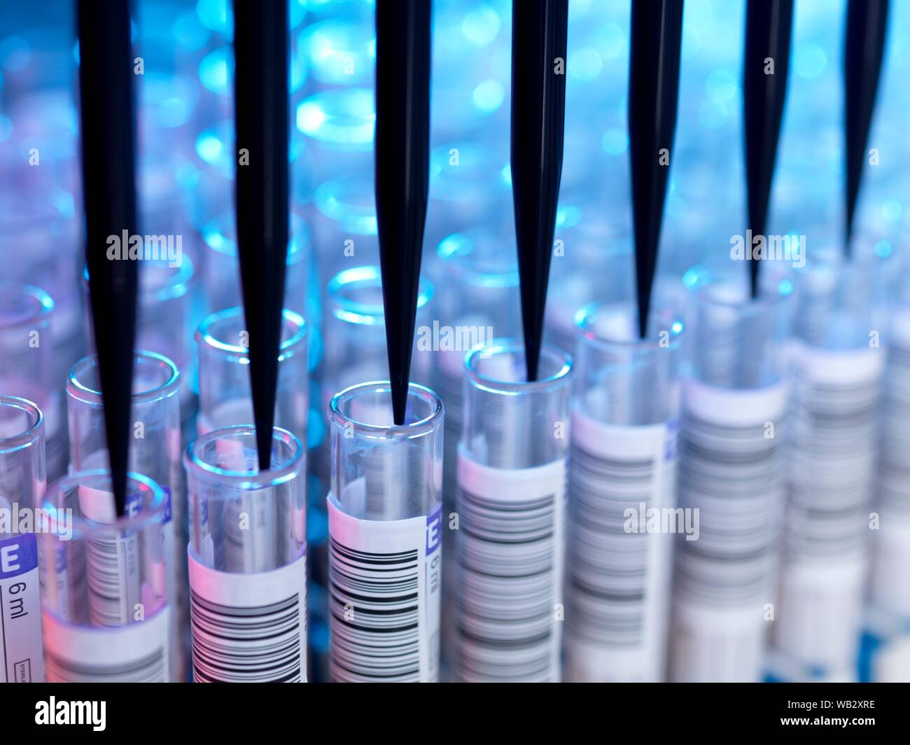 Automated blood sample testing in laboratory for healthcare screening ...