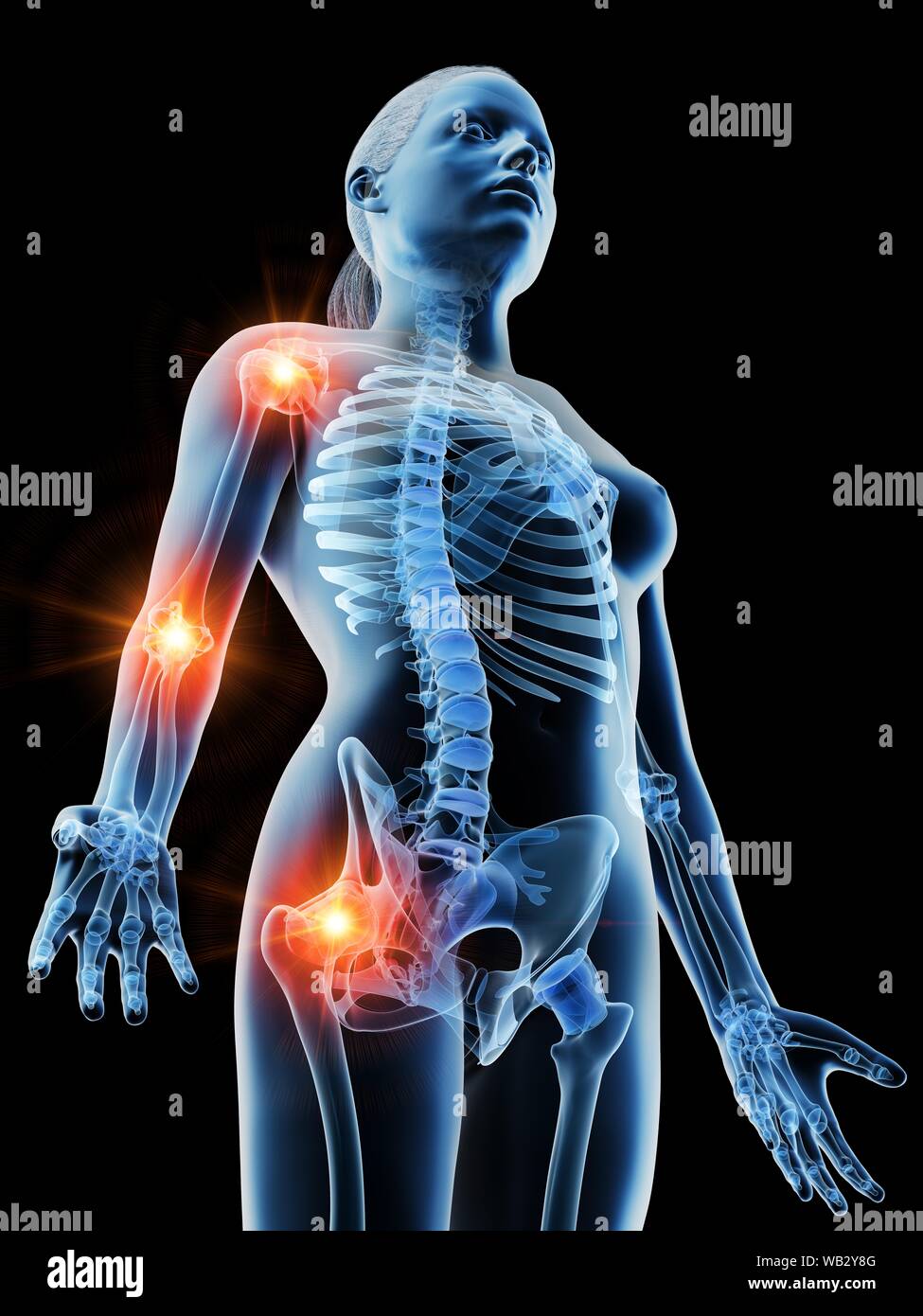 Joint pain, conceptual computer illustration Stock Photo - Alamy