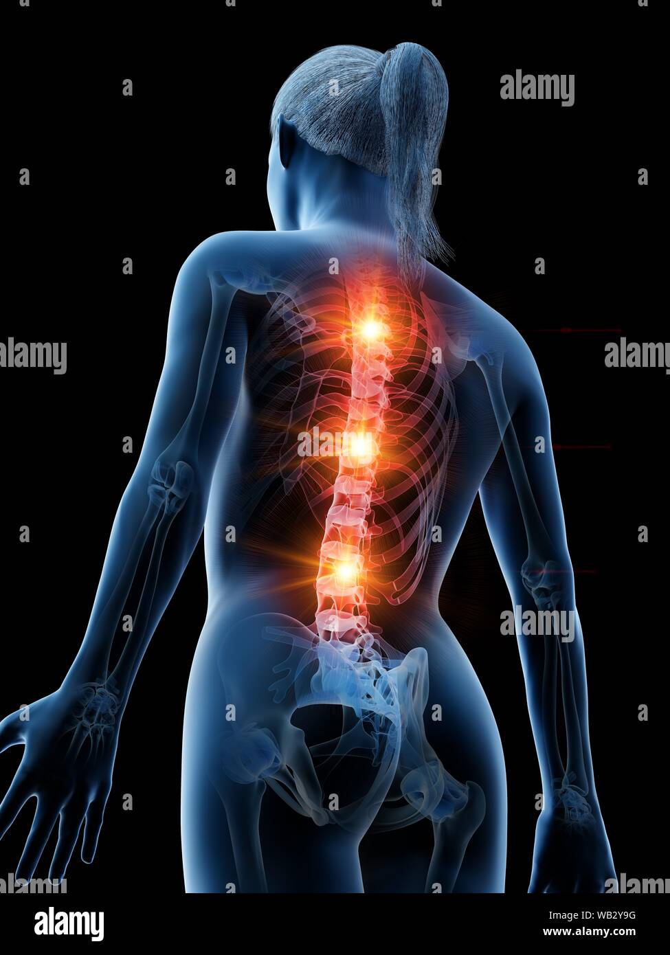 Back pain conceptual artwork hi-res stock photography and images - Alamy