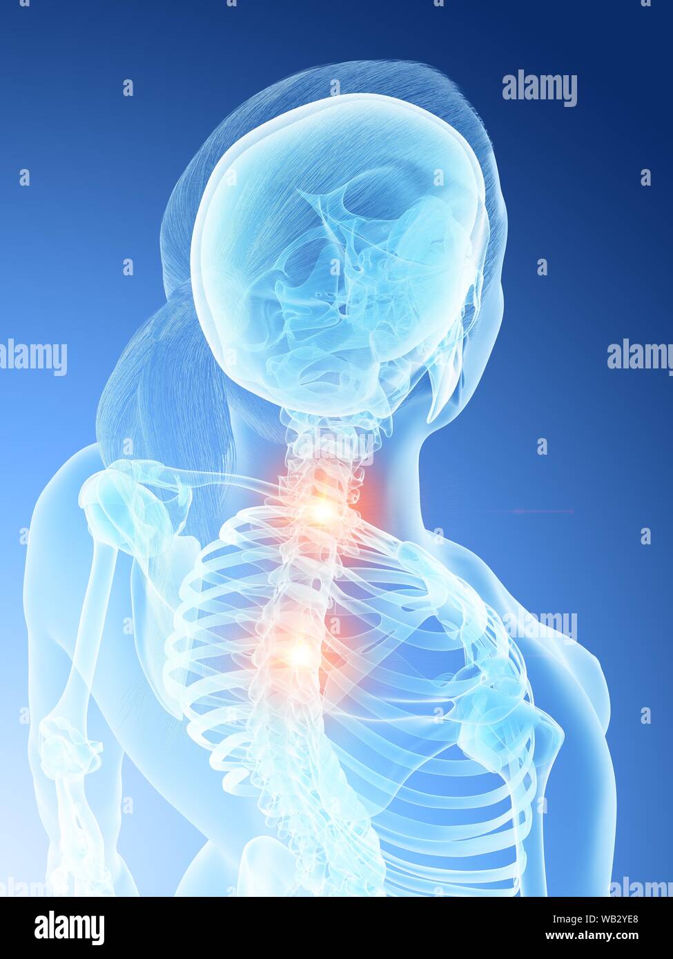 3d rendering medical illustration cervical hi-res stock photography and ...