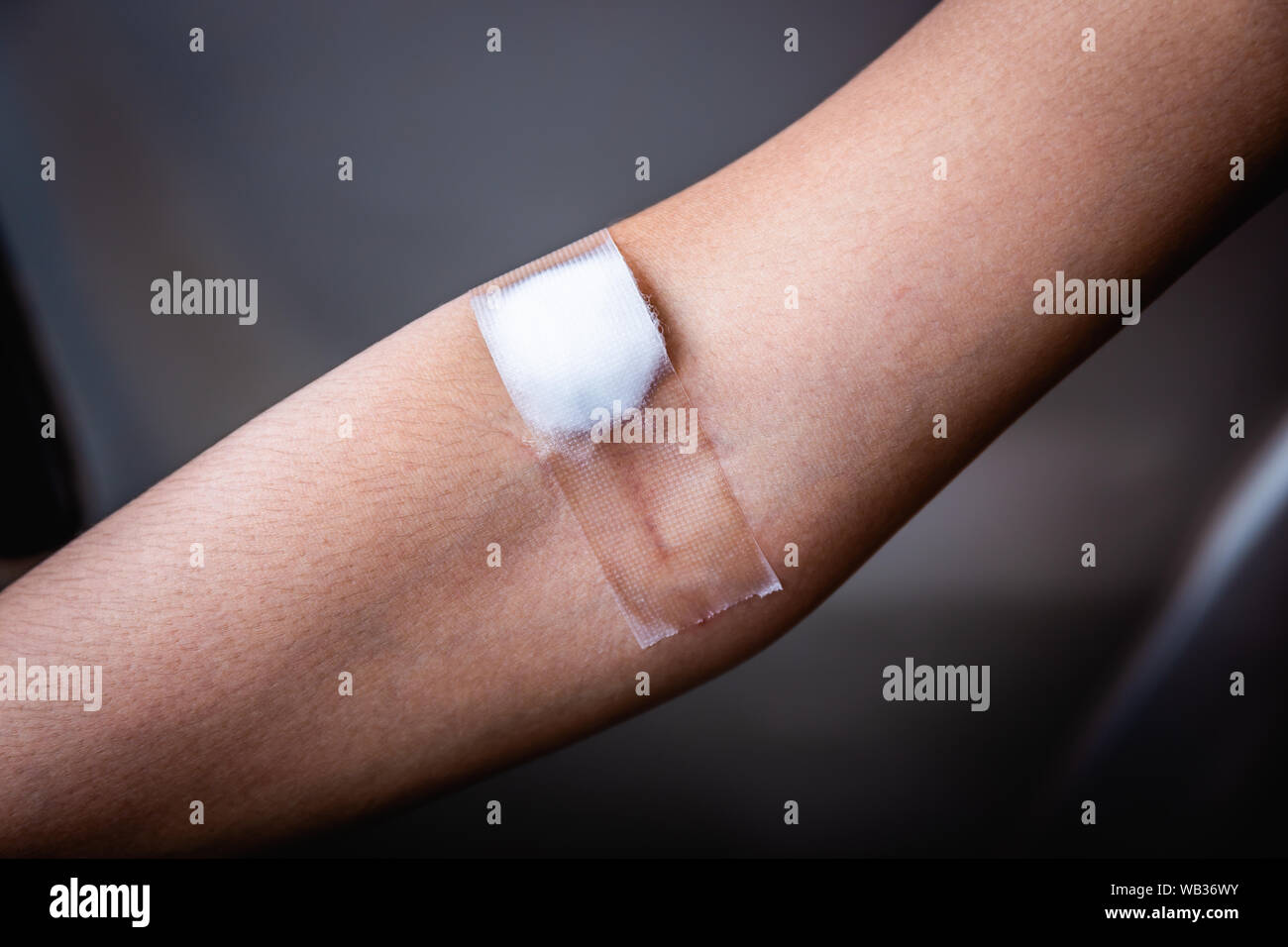 Closeup of cotton closed the wound after blood collection or blood ...