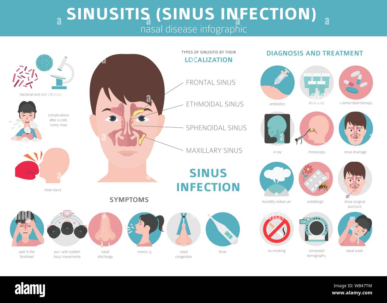 Nasal diseases. Sinusitis, sinus infection diagnosis and treatment medical infographic design ...