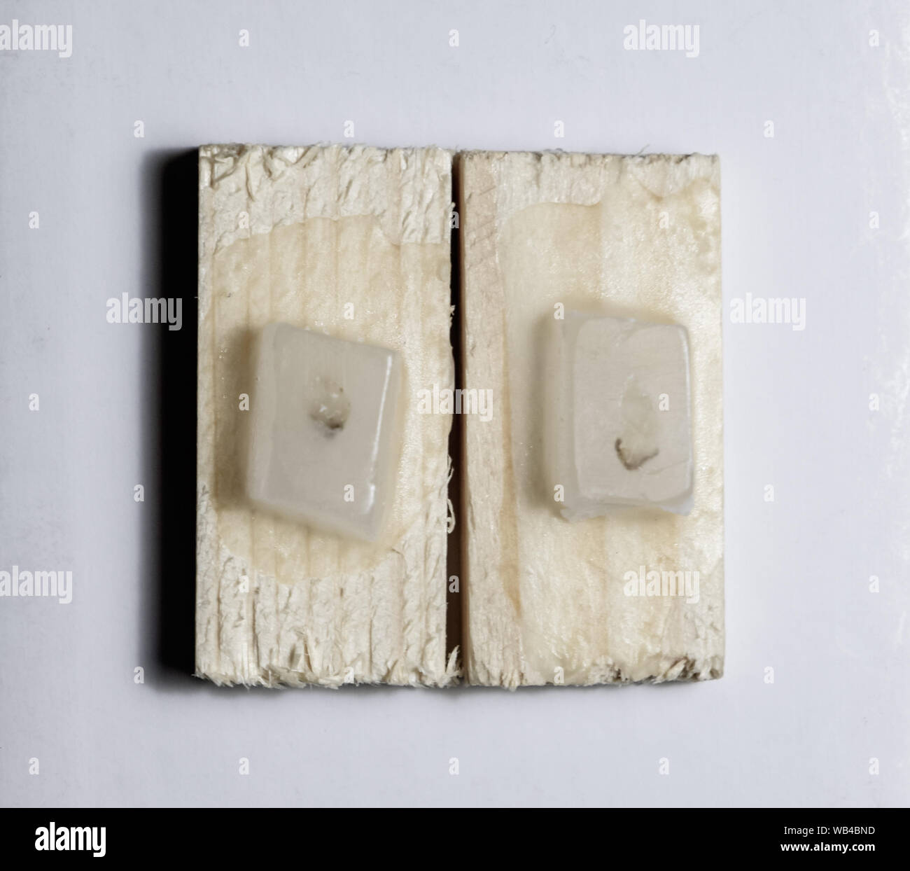 Paraffin blocks with cancer samples, samples for histological ...