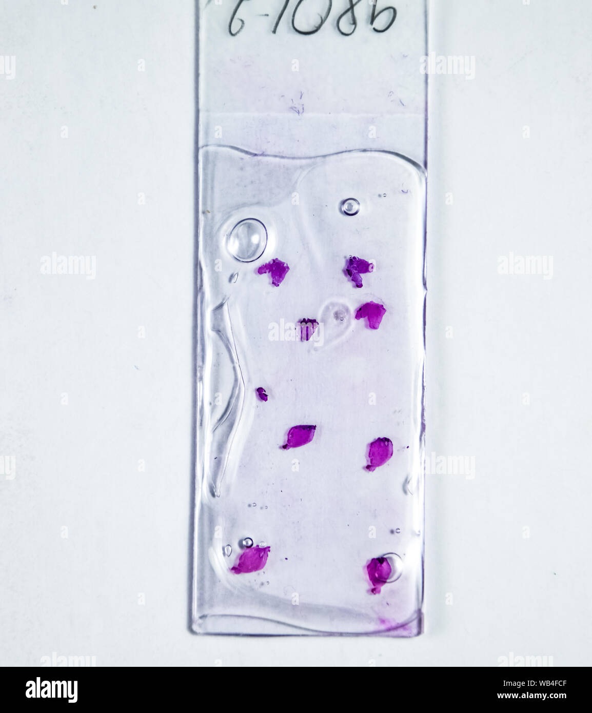 Slices of the tumor under glass. Histological examination of tumor ...