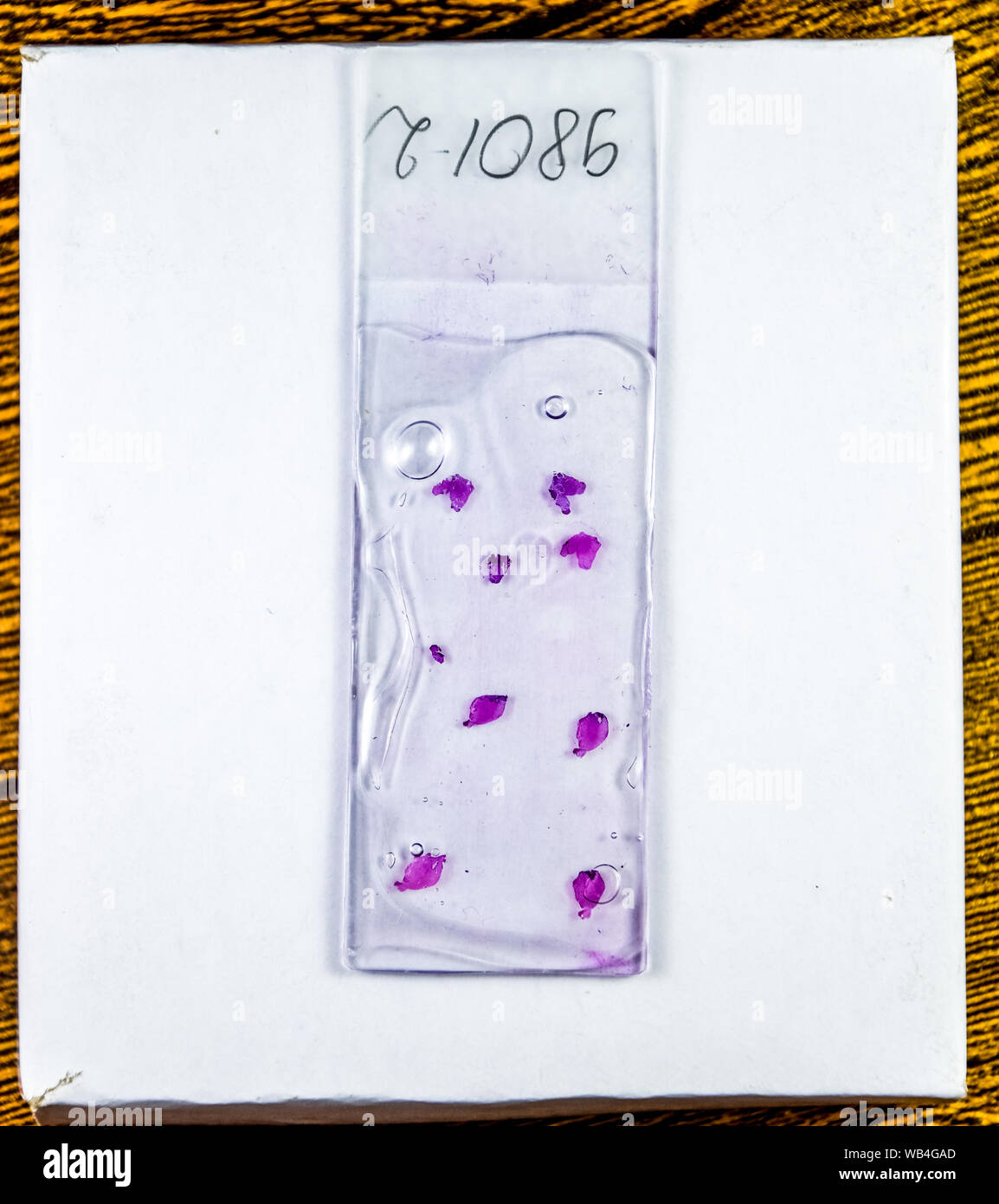 Slices of the tumor under glass. Histological examination of tumor ...