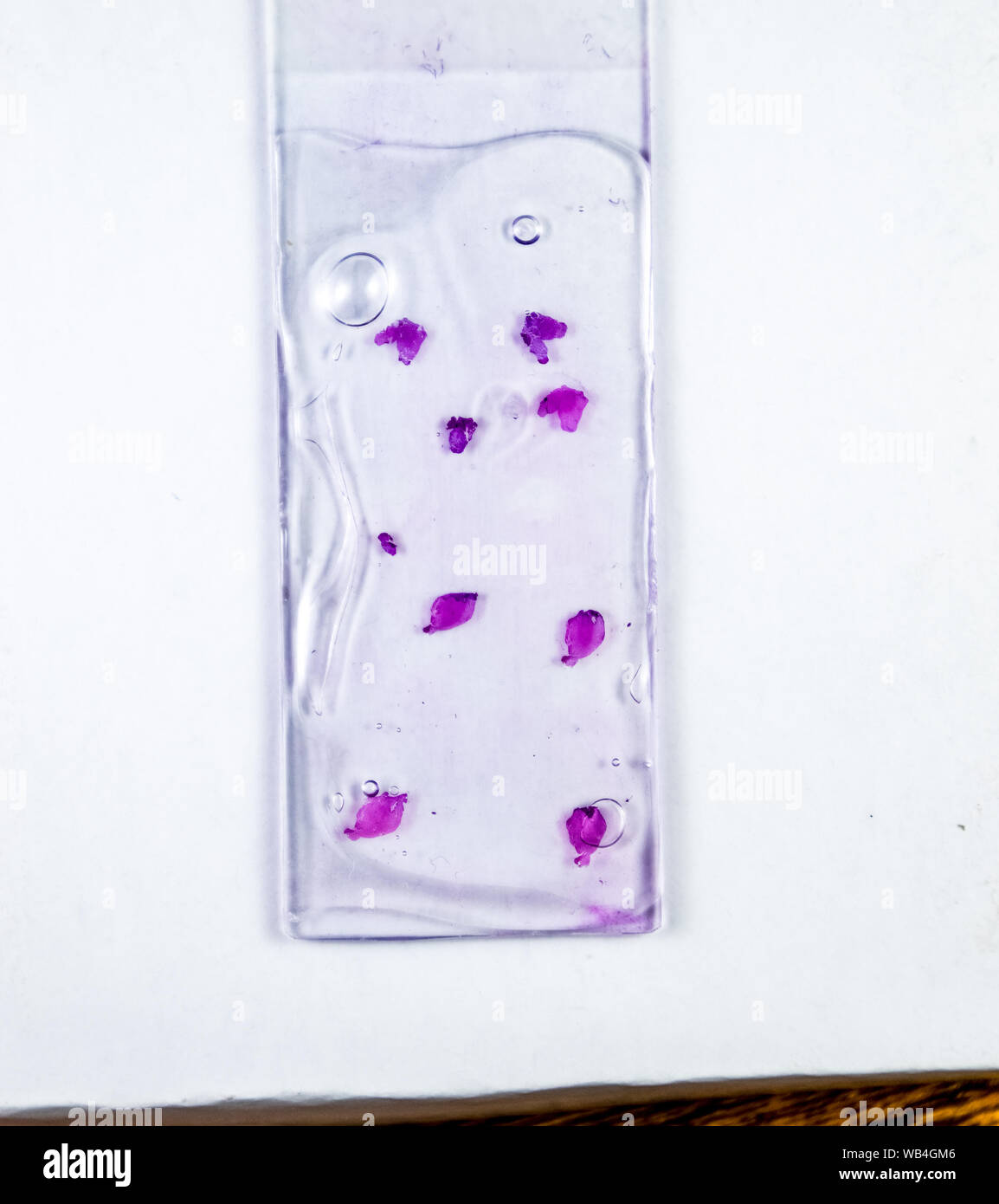 Slices of the tumor under glass. Histological examination of tumor ...