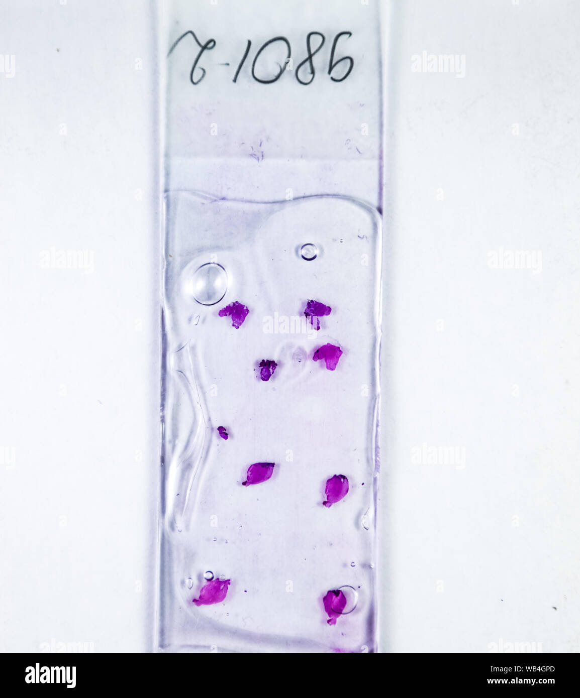 Cervical cytology hi-res stock photography and images - Alamy