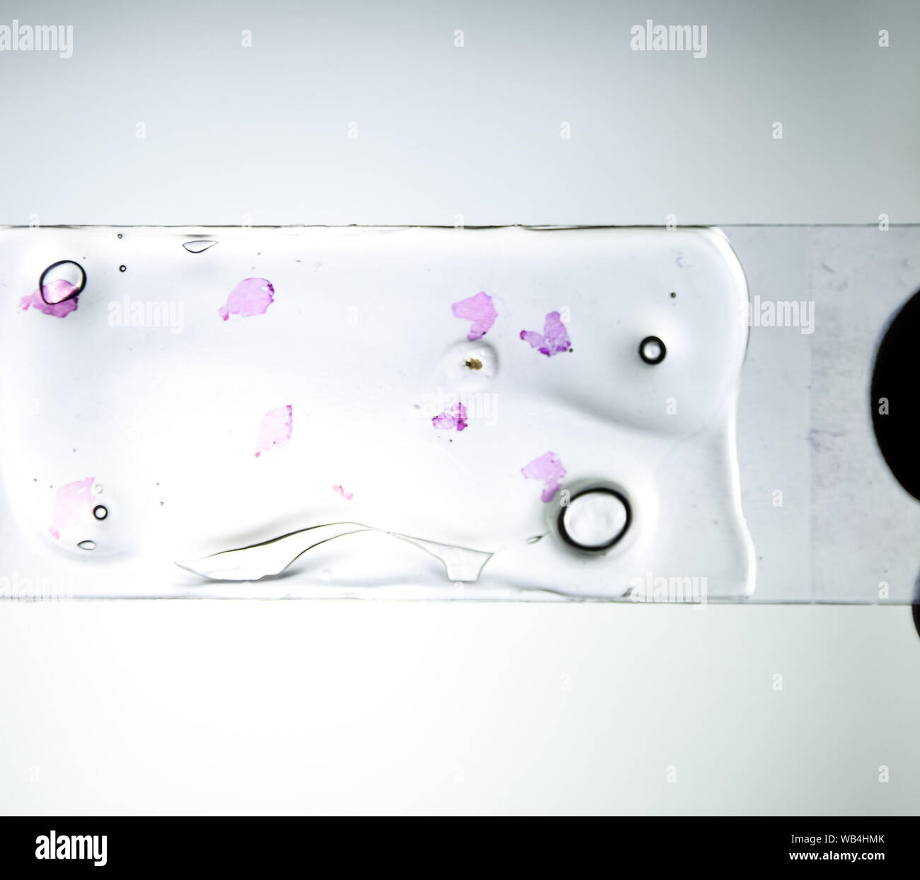 Slices of the tumor under glass. Histological examination of tumor ...