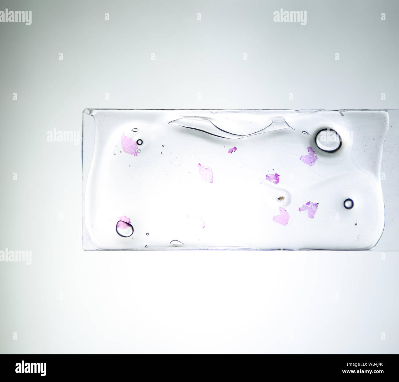 Slices of the tumor under glass. Histological examination of tumor ...