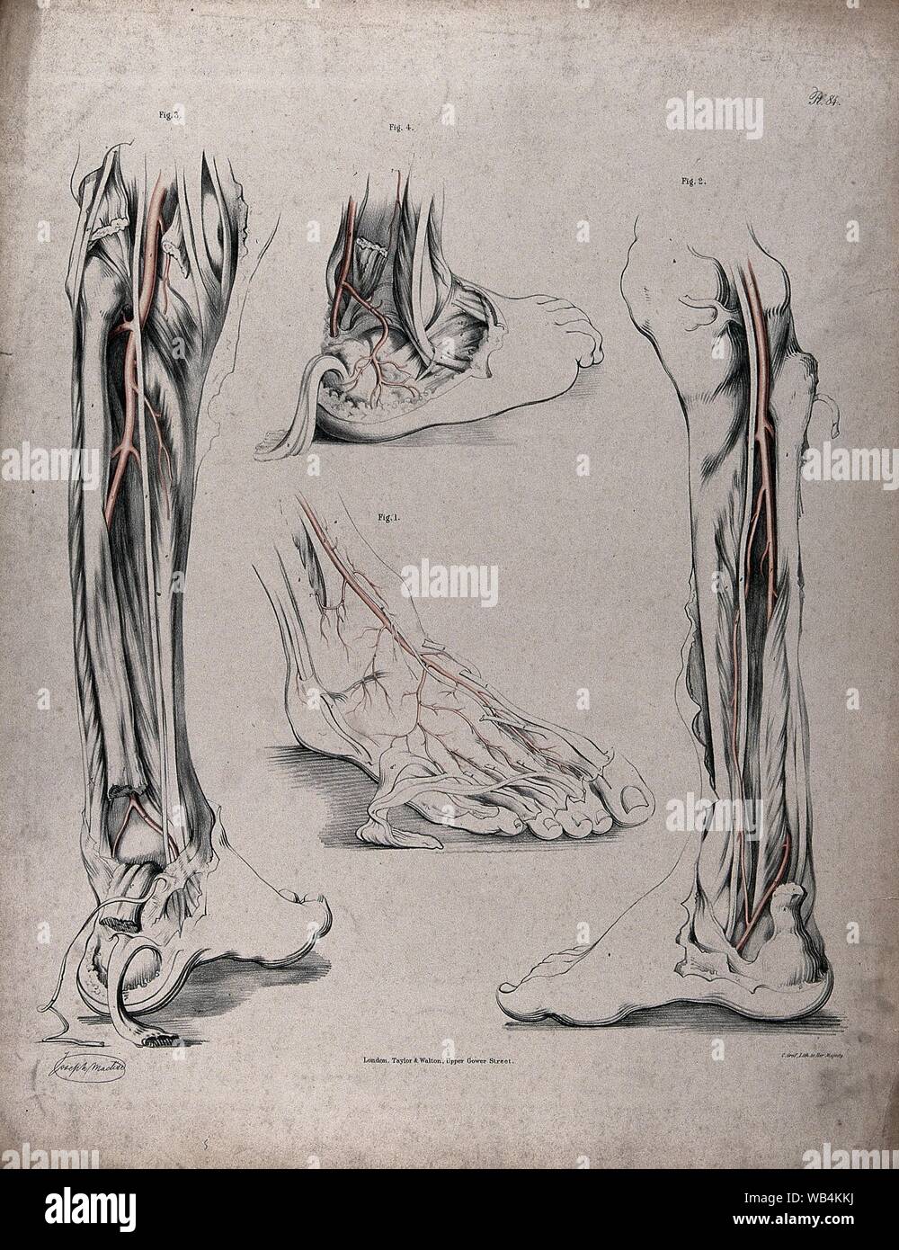 Lower leg arteries hi-res stock photography and images - Alamy