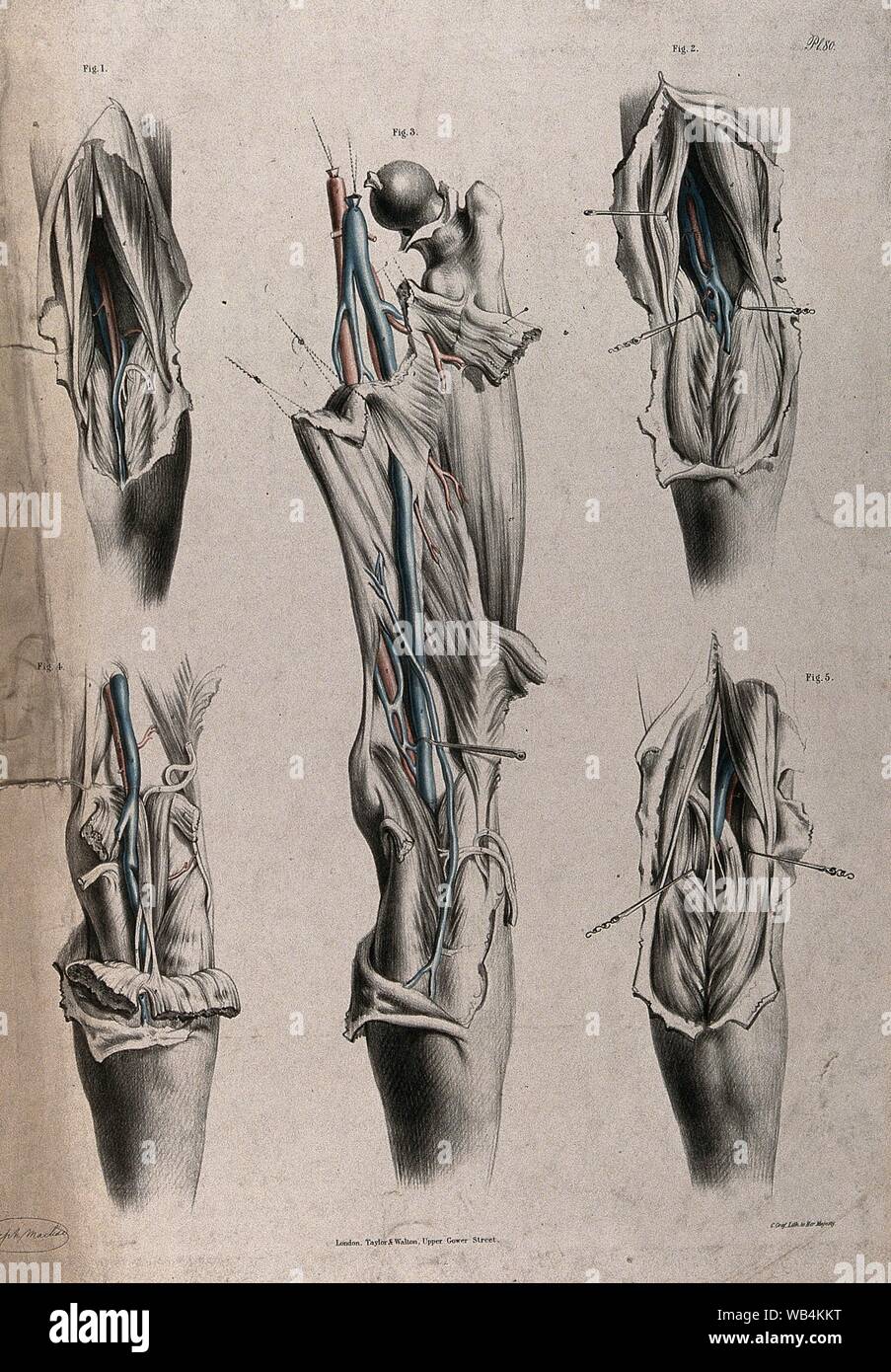 Circulatory system in male anatomy hi-res stock photography and images ...