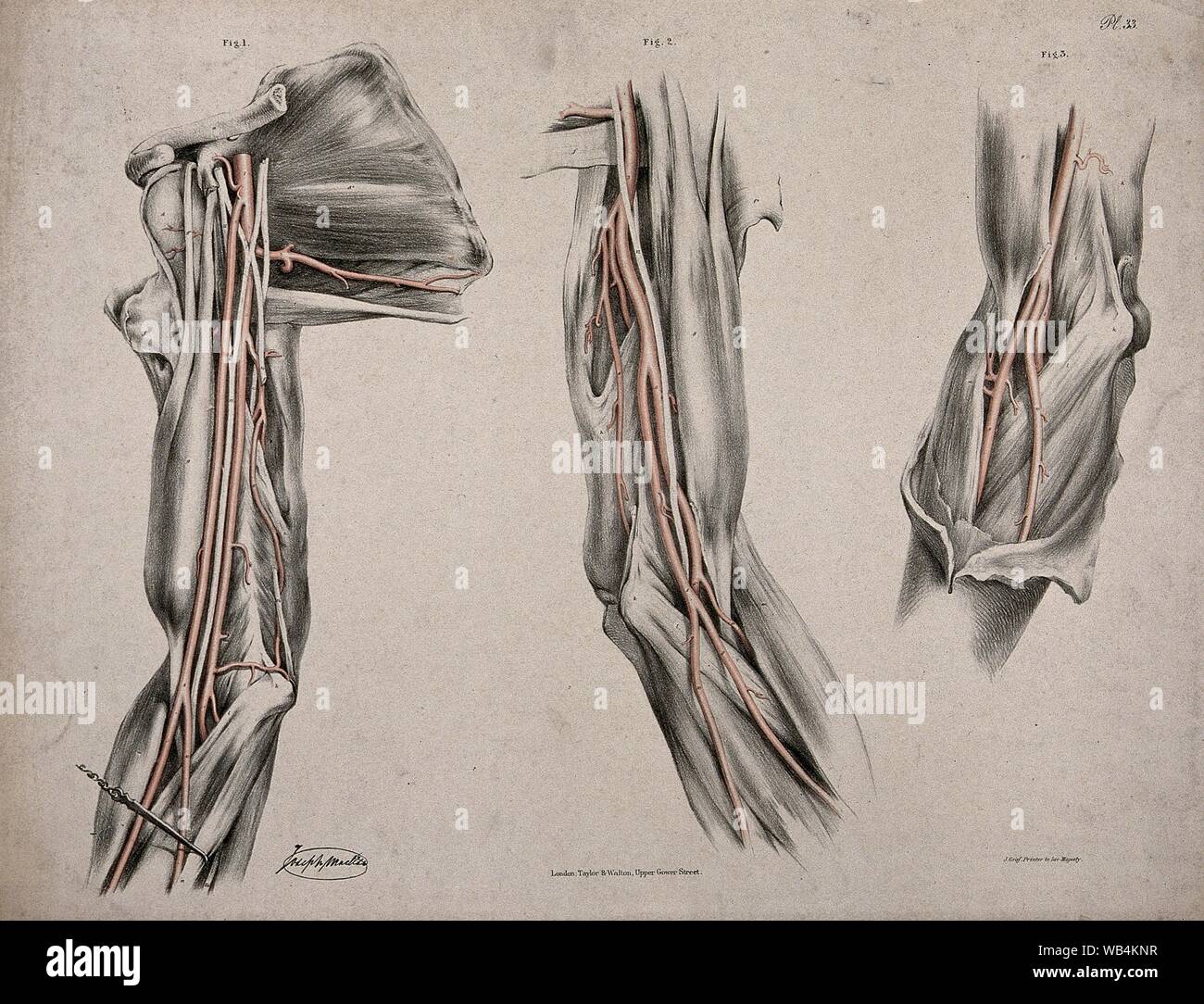 Anatomical dissections hi-res stock photography and images - Alamy