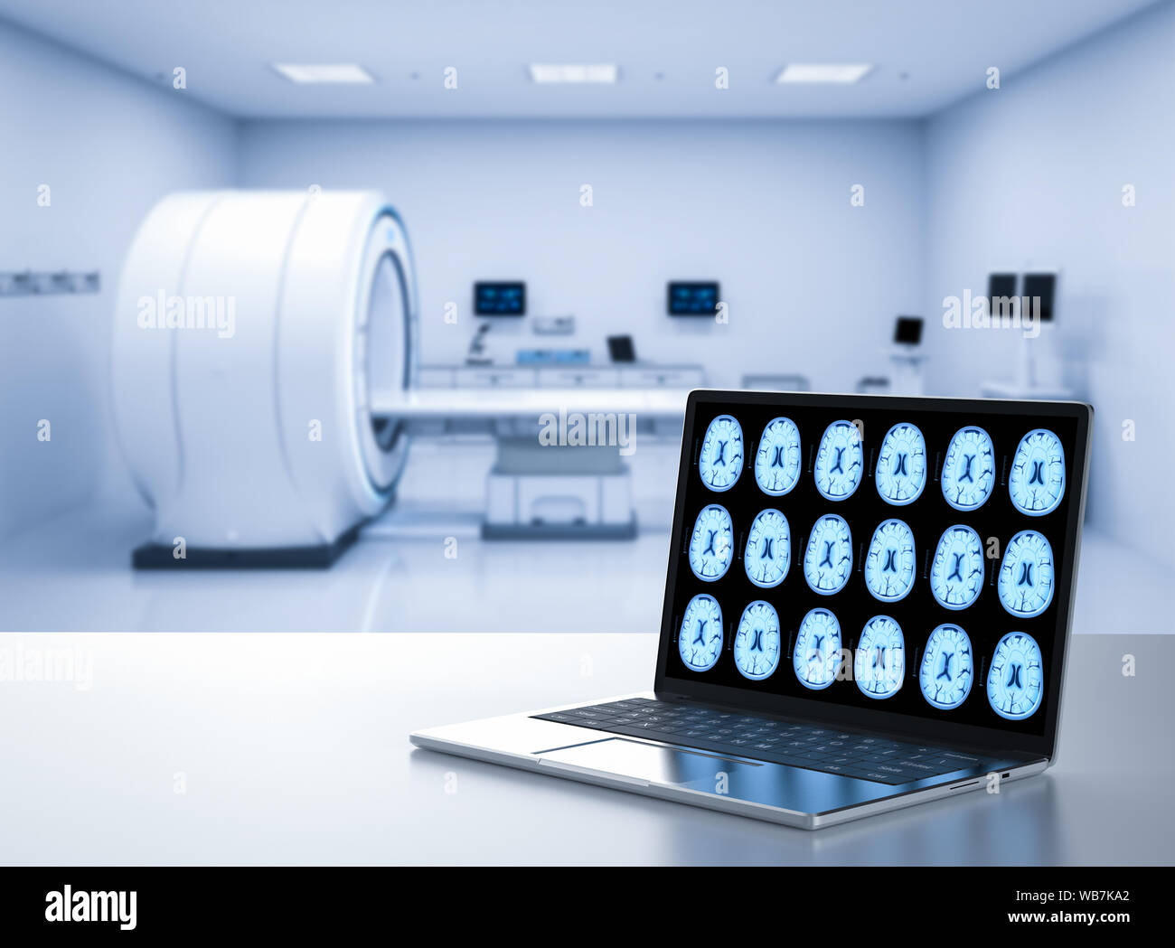 Mri brain scan computer screen hi-res stock photography and images - Alamy